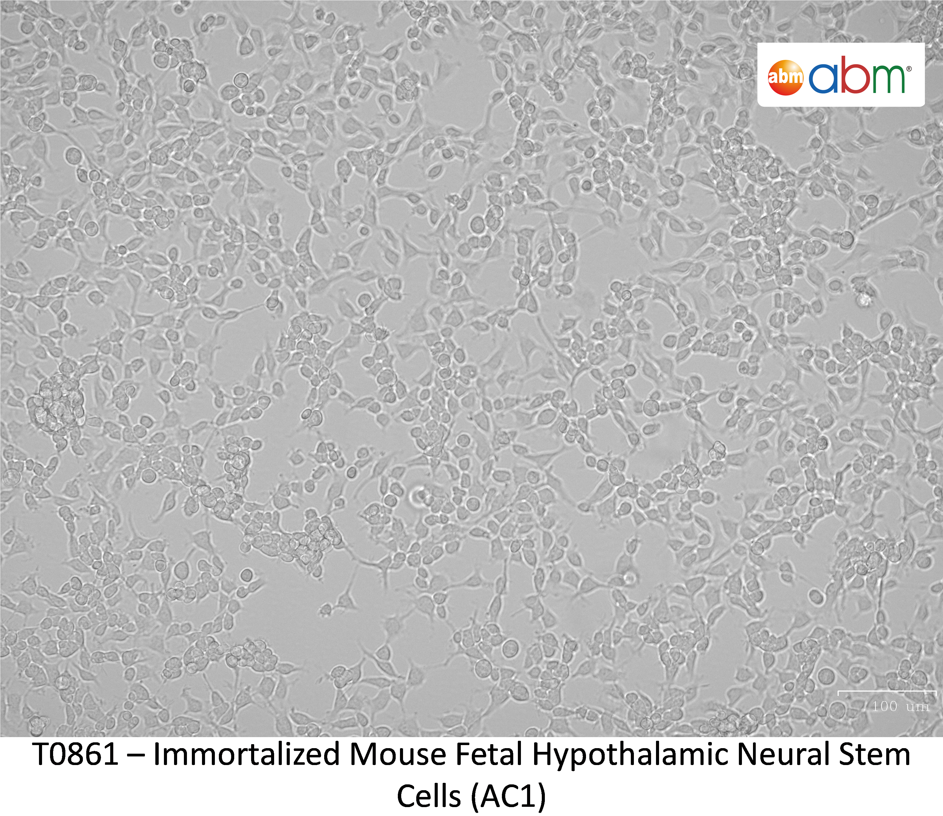 Immortalized Mouse Fetal Hypothalamic Neural Stem Cells (AC1) | Applied ...