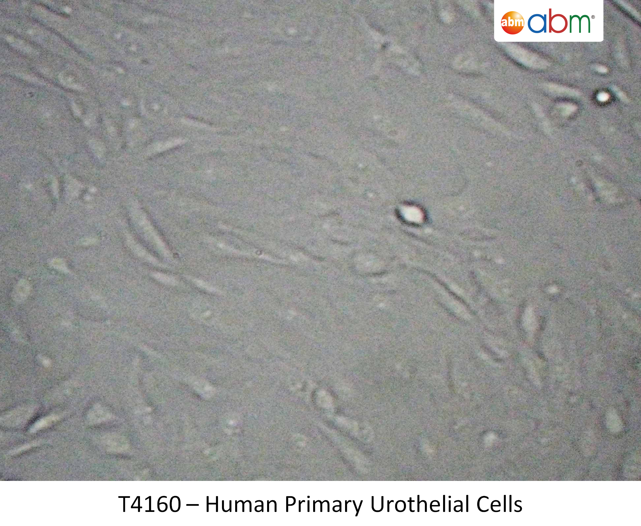 Human Primary Urothelial Cells | Applied Biological Materials Inc.