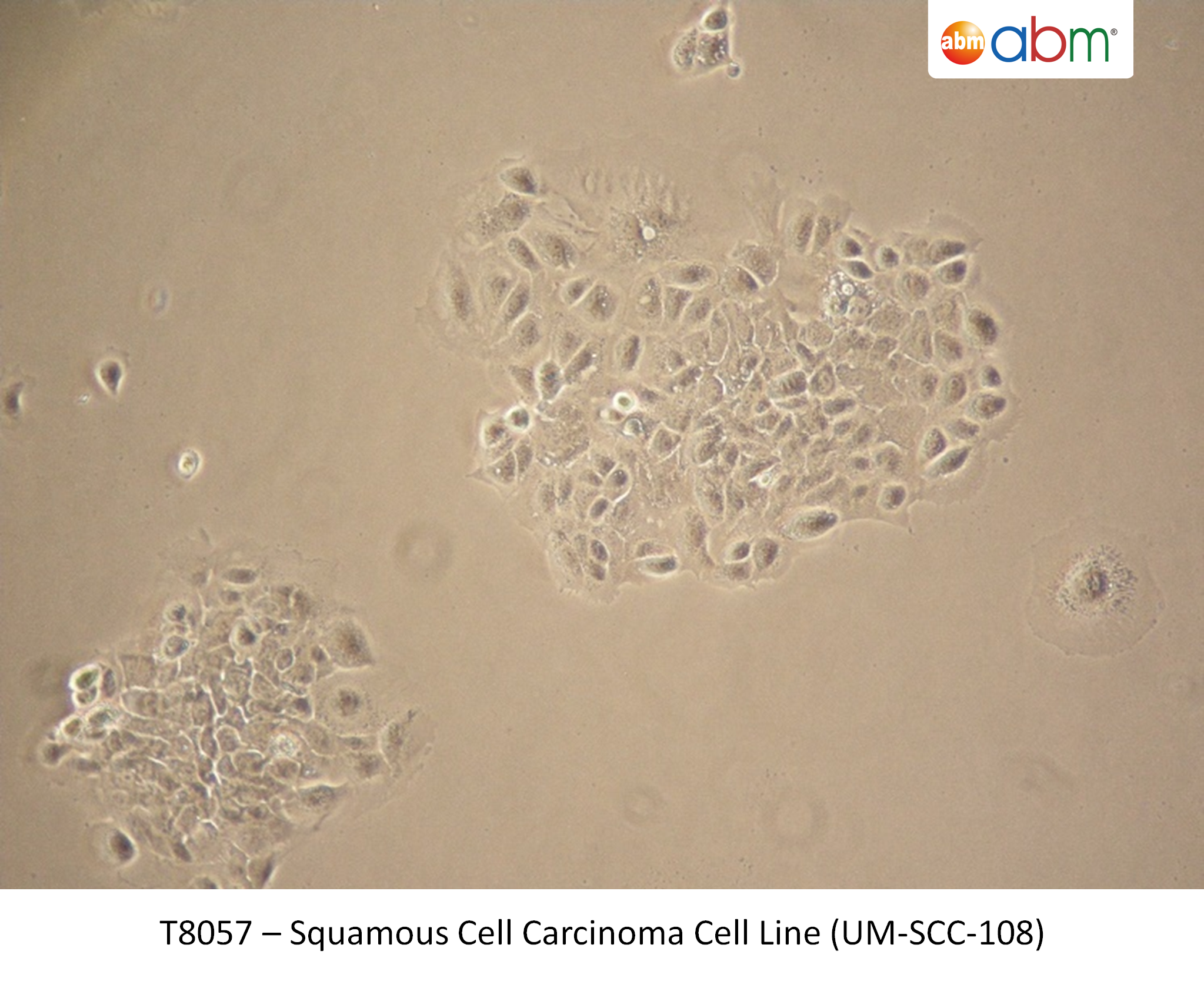 Squamous Cell Carcinoma Cell Line (UM-SCC-108) | Applied Biological ...