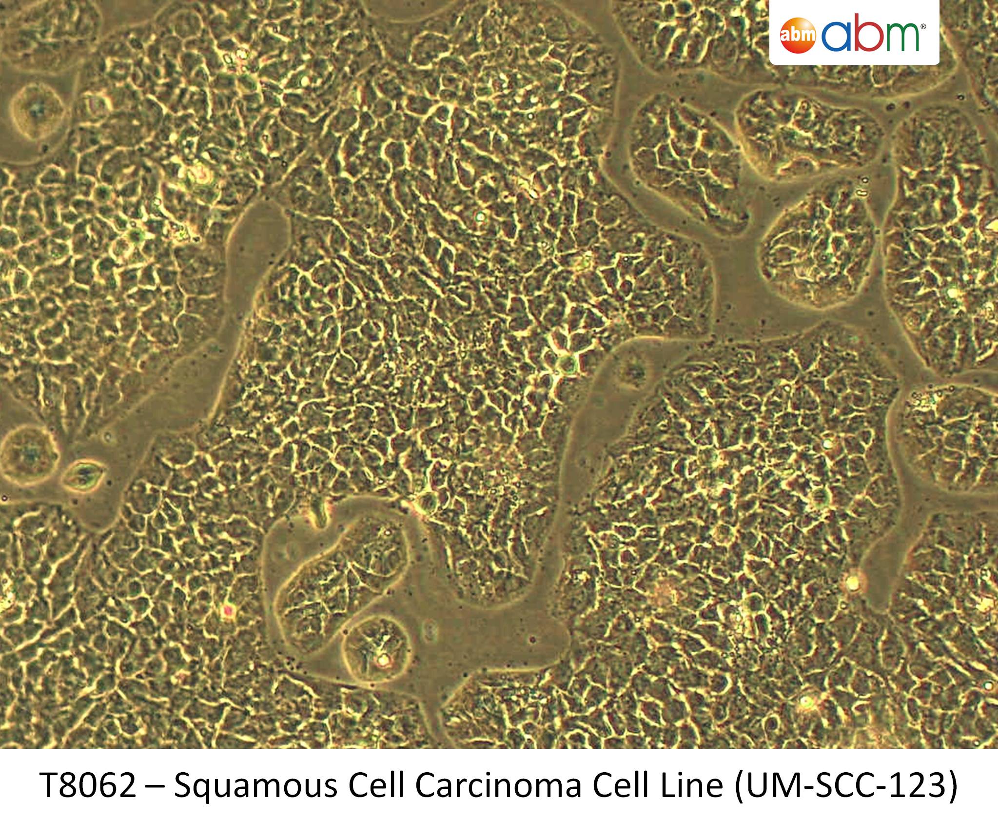 Squamous Cell Carcinoma Cell Line (UM-SCC-123) | Applied Biological ...