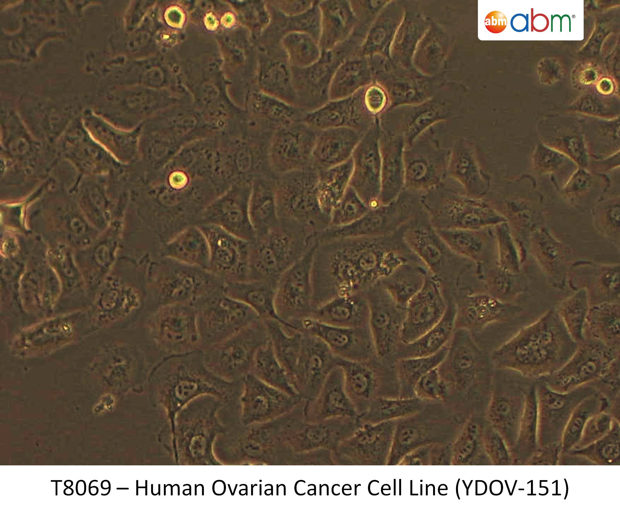 Human Ovarian Cancer Cell Line (YDOV-151) | Applied Biological ...
