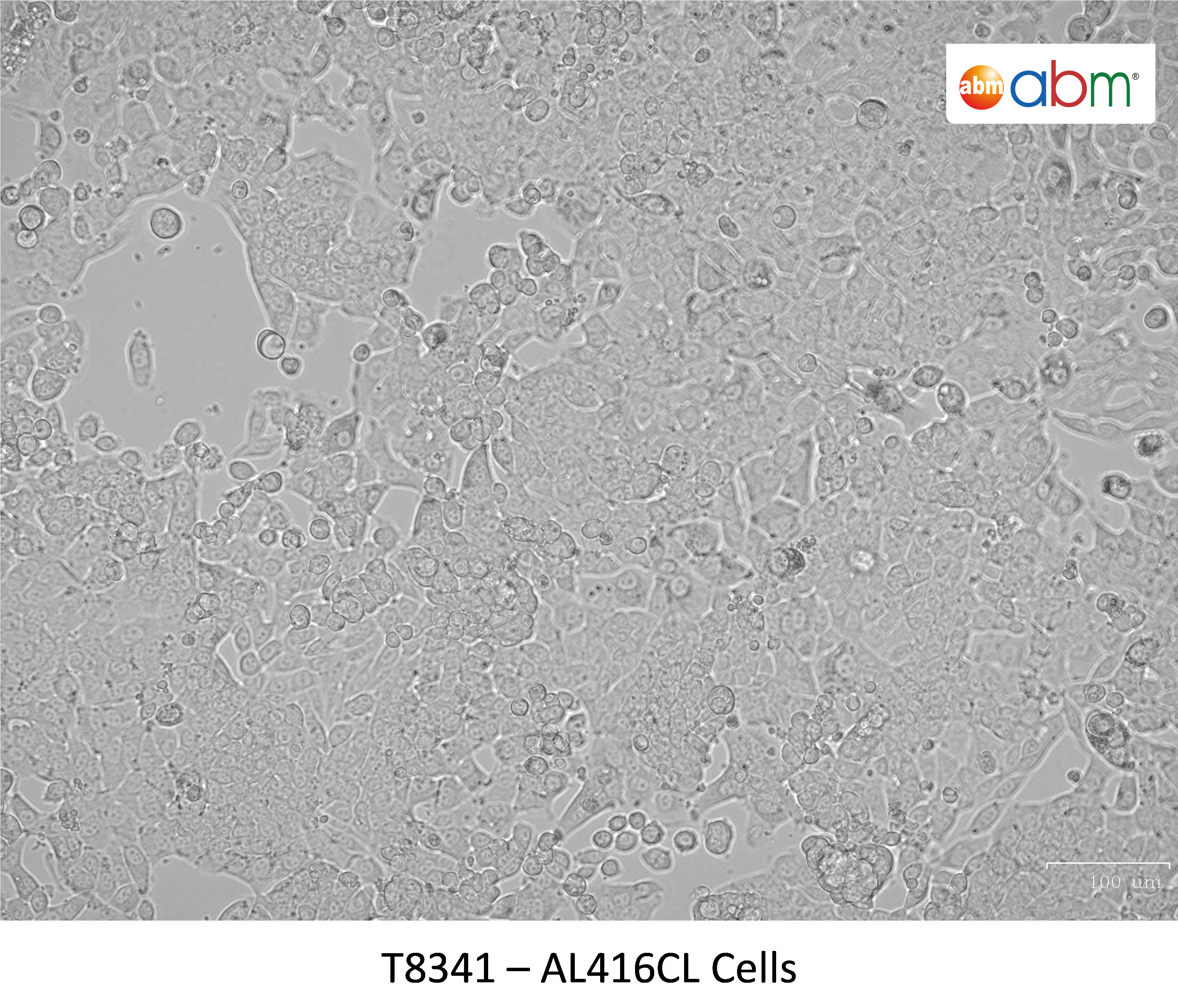 AL416CL Cells | Applied Biological Materials Inc.