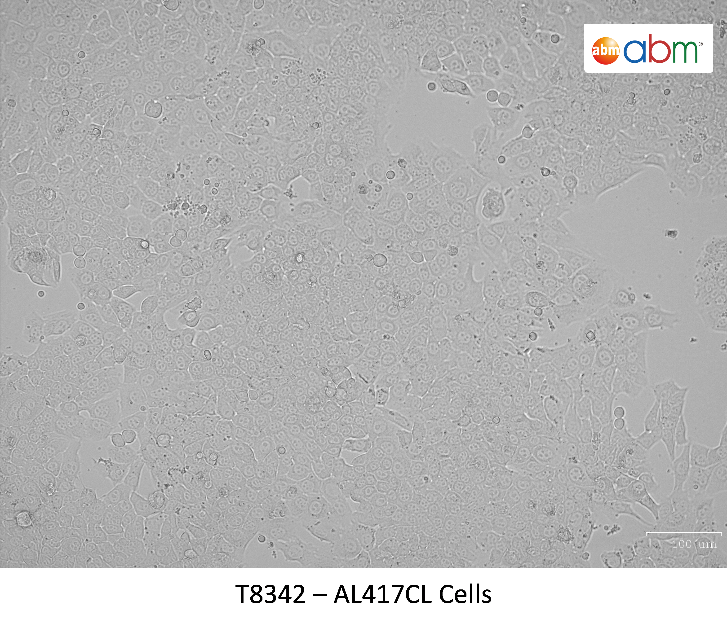 AL417CL Cells | Applied Biological Materials Inc.