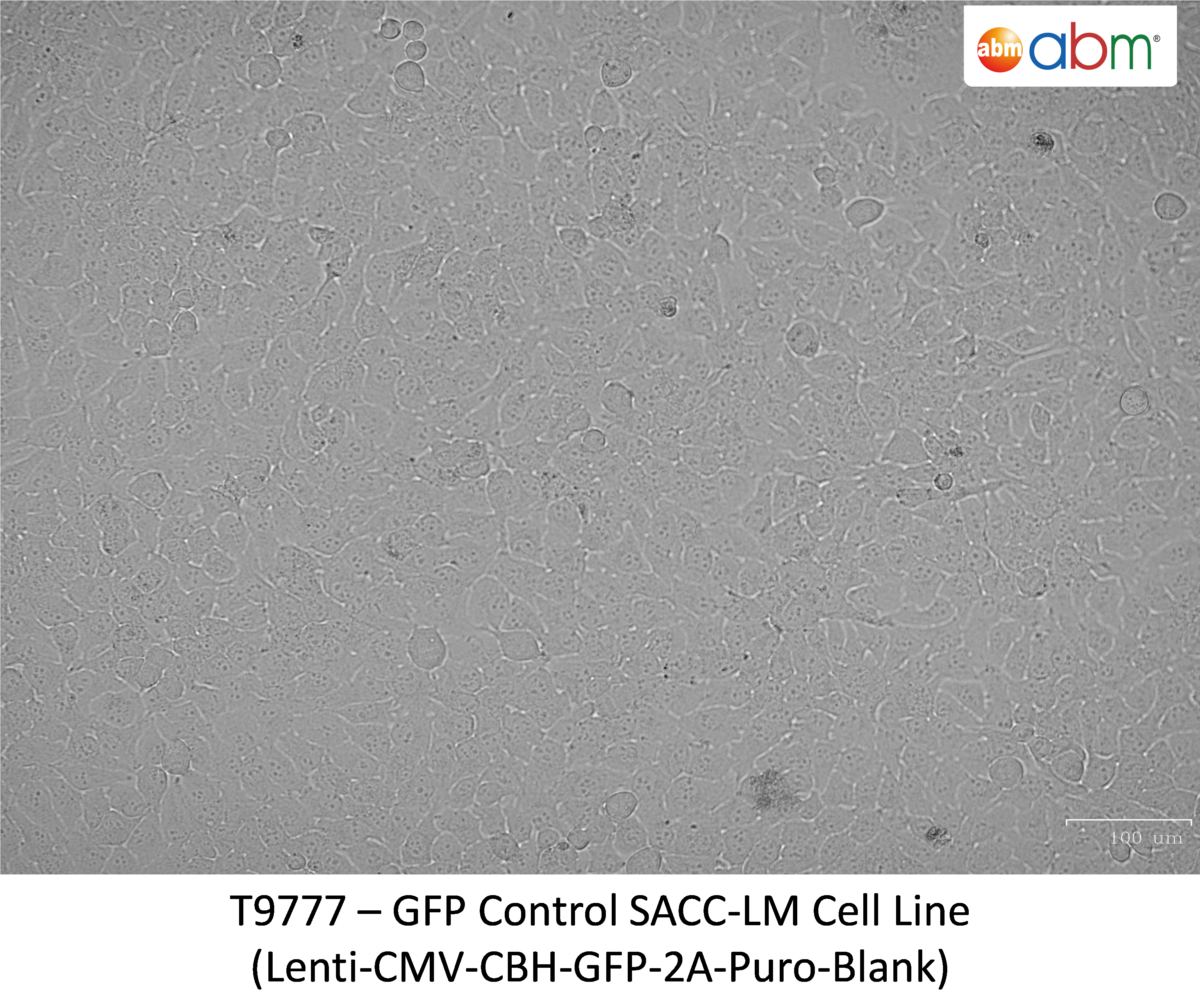 GFP Control SACC-LM Cell Line (Lenti-CMV-CBH-GFP-2A-Puro-Blank ...