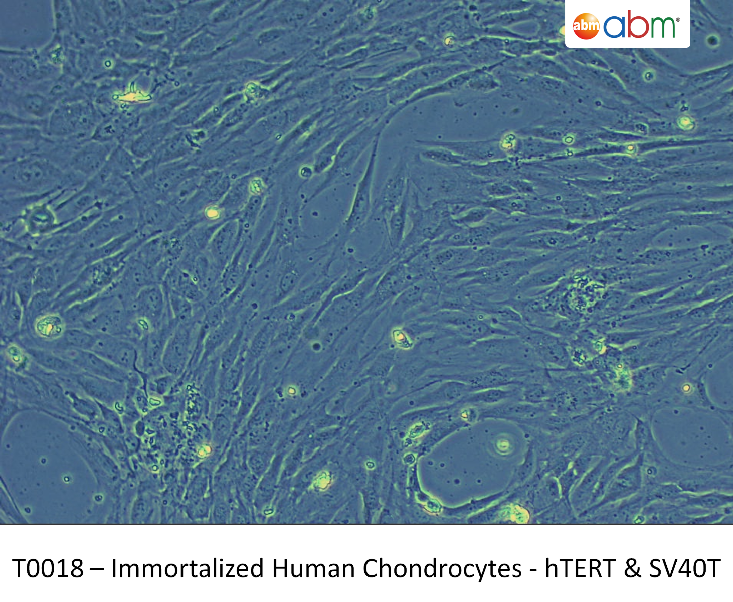 Immortalized Human Chondrocytes - hTERT & SV40T - H. sapiens/Human ...