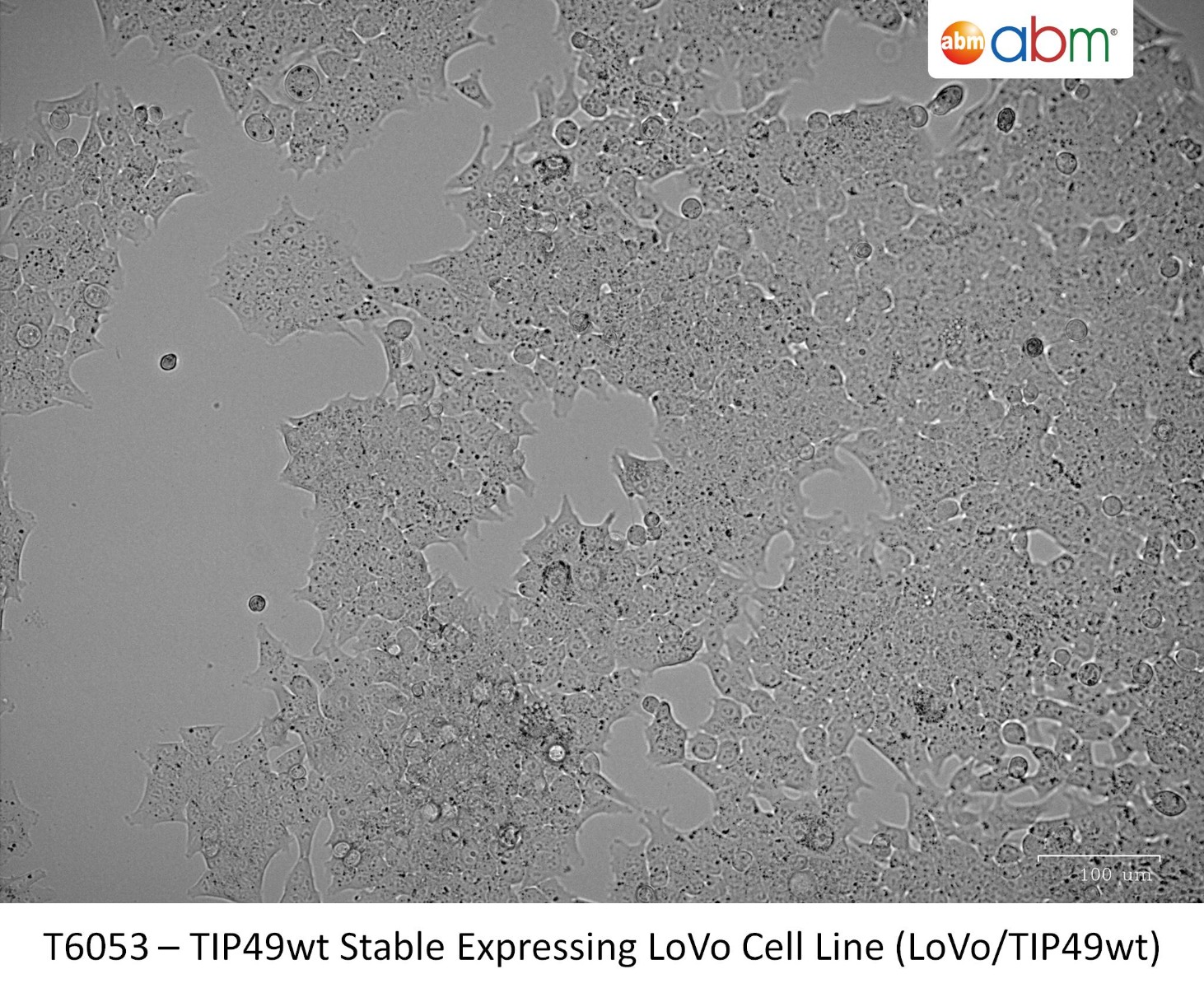LoVo Control Cells (LoVo/vec) | Applied Biological Materials Inc.