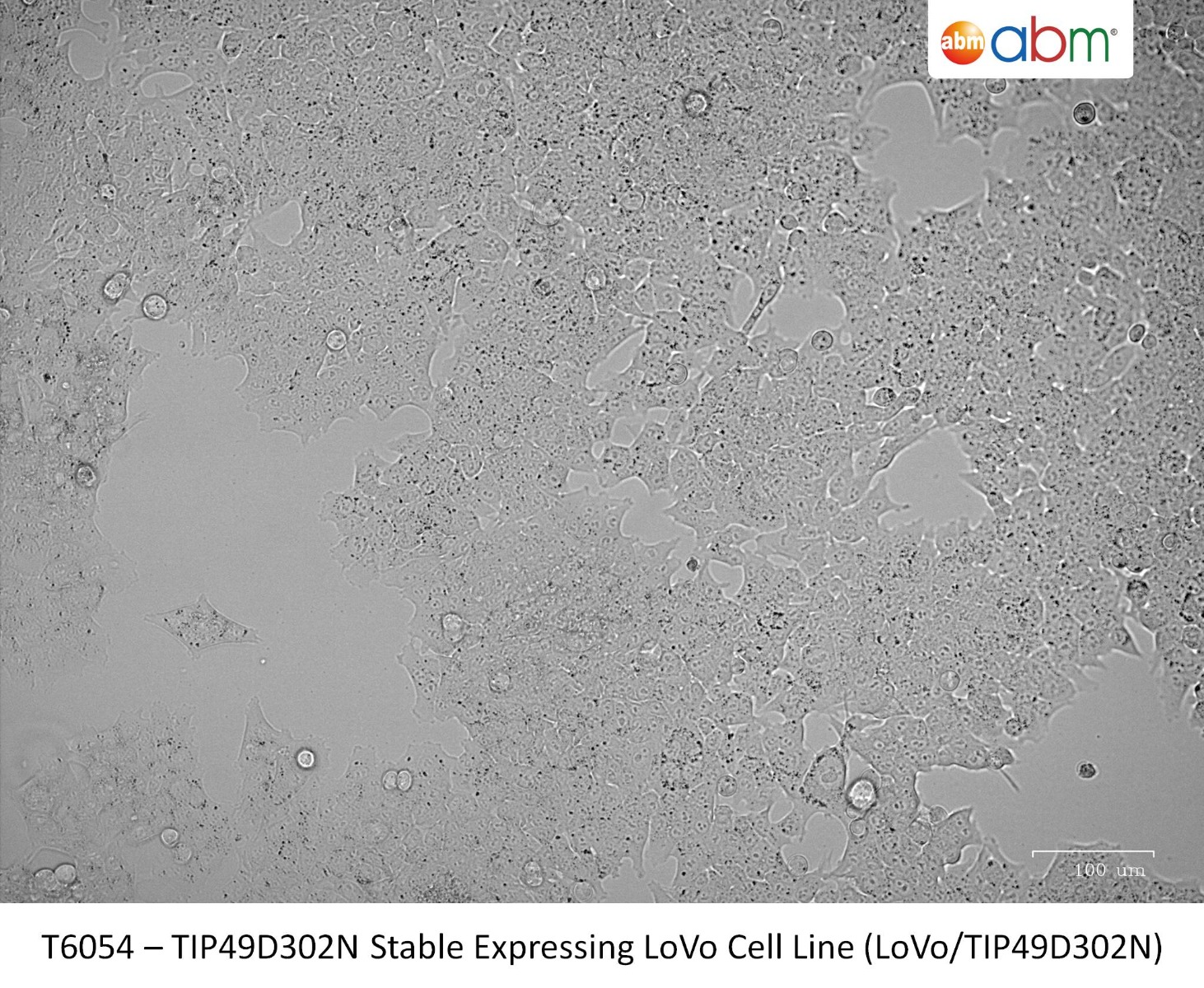 LoVo Control Cells (LoVo/vec) | Applied Biological Materials Inc.