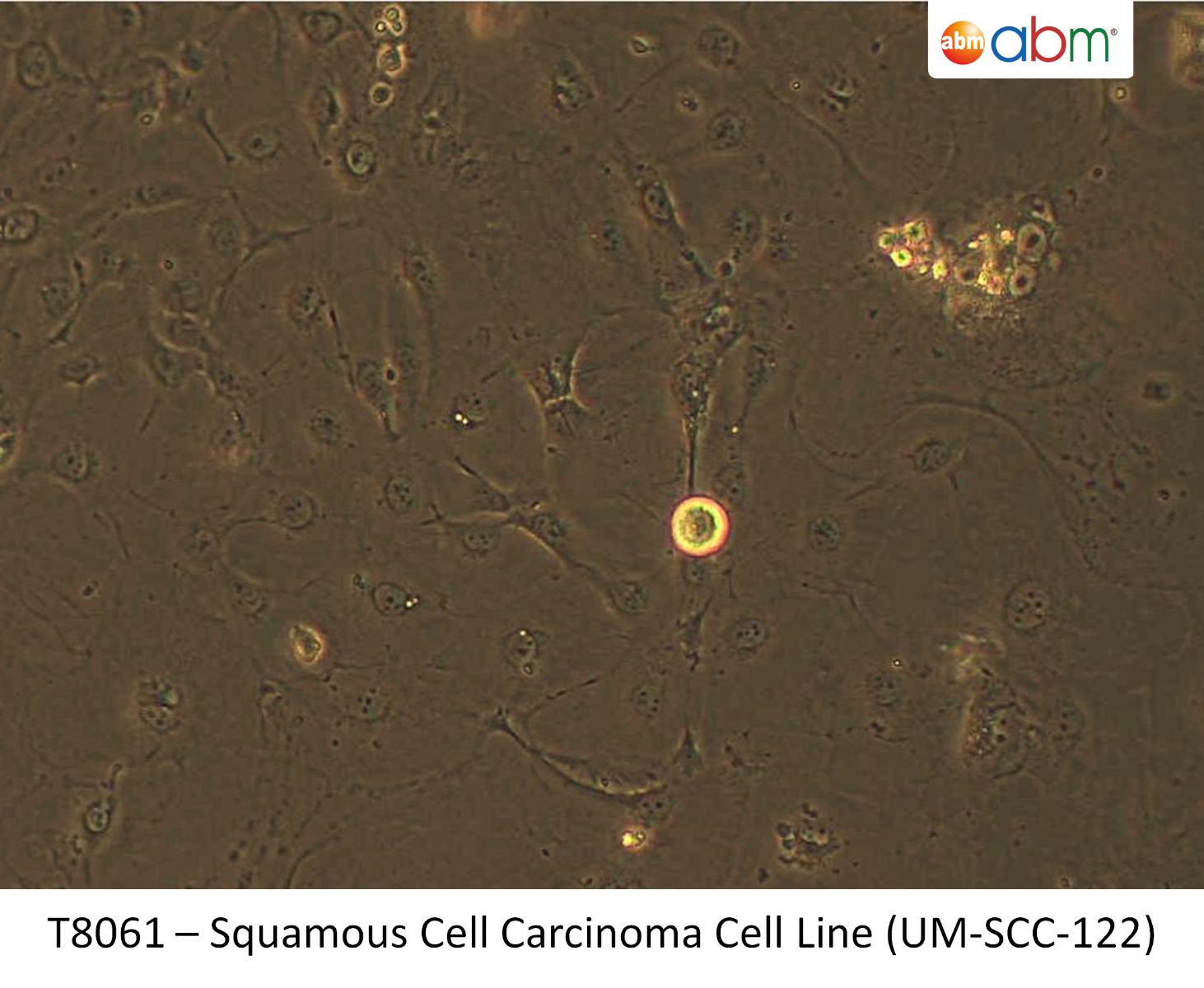 Squamous Cell Carcinoma Cell Line (UM-SCC-122) | Applied Biological ...