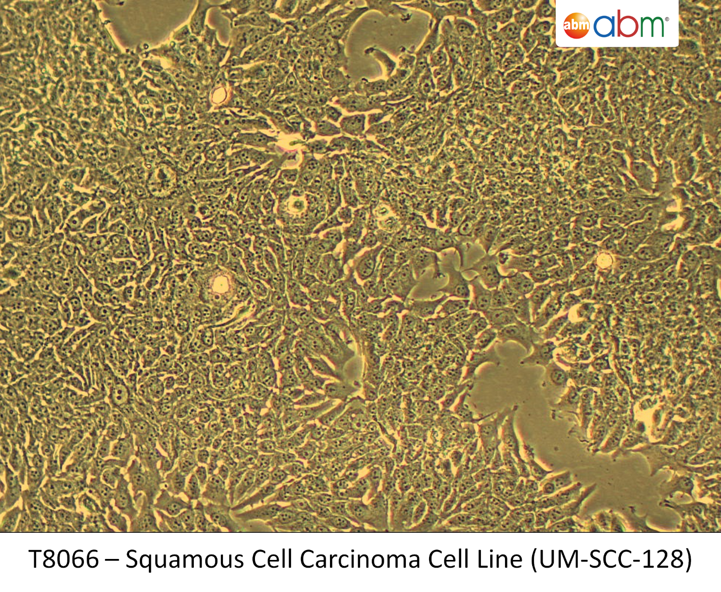 Squamous Cell Carcinoma Cell Line (UM-SCC-128) | Applied Biological ...