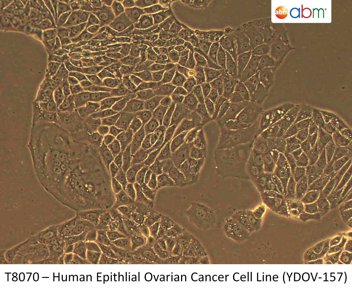 Vero Cell Line | Applied Biological Materials Inc.