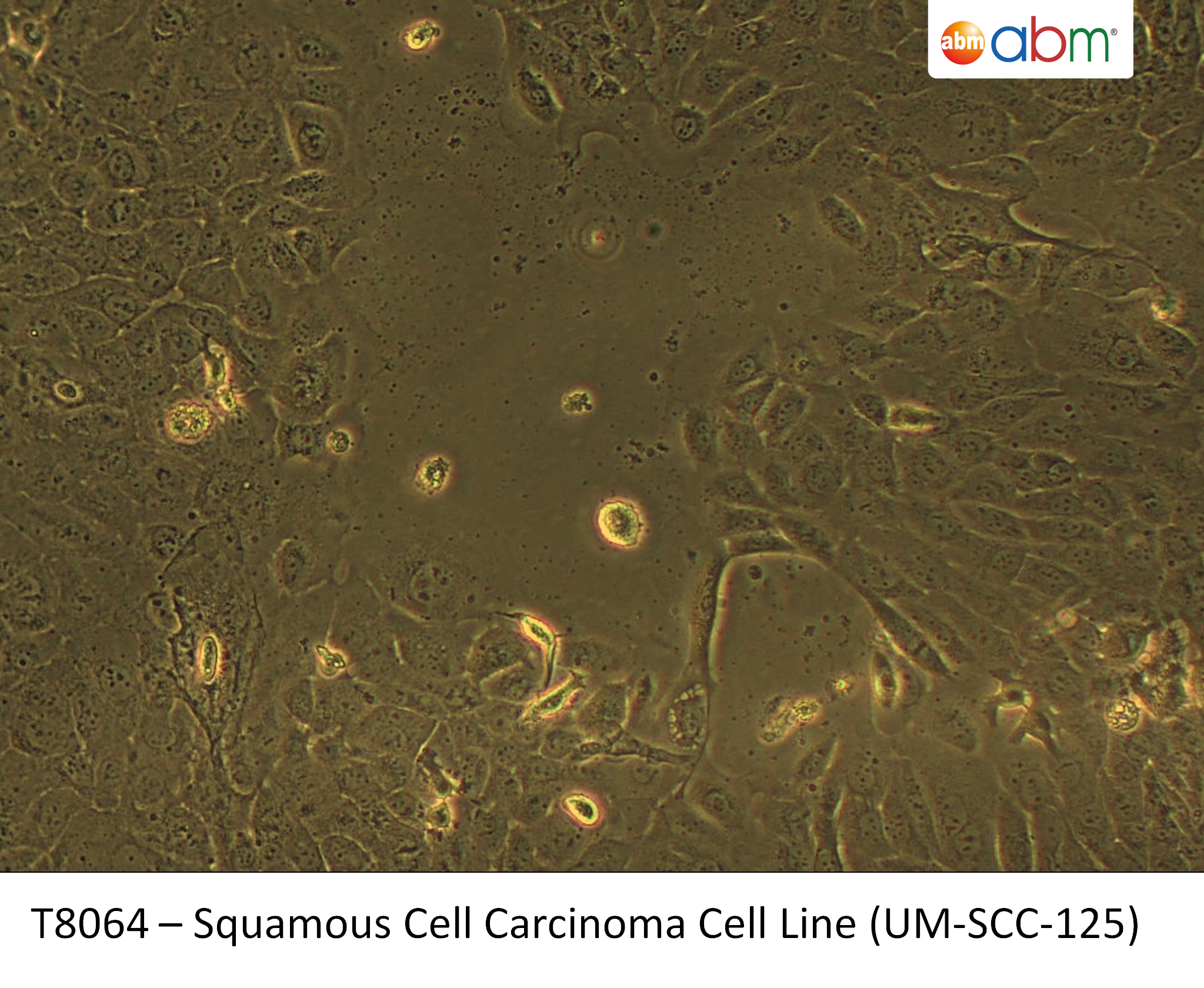 Squamous Cell Carcinoma Cell Line (UM-SCC-108) | Applied Biological ...