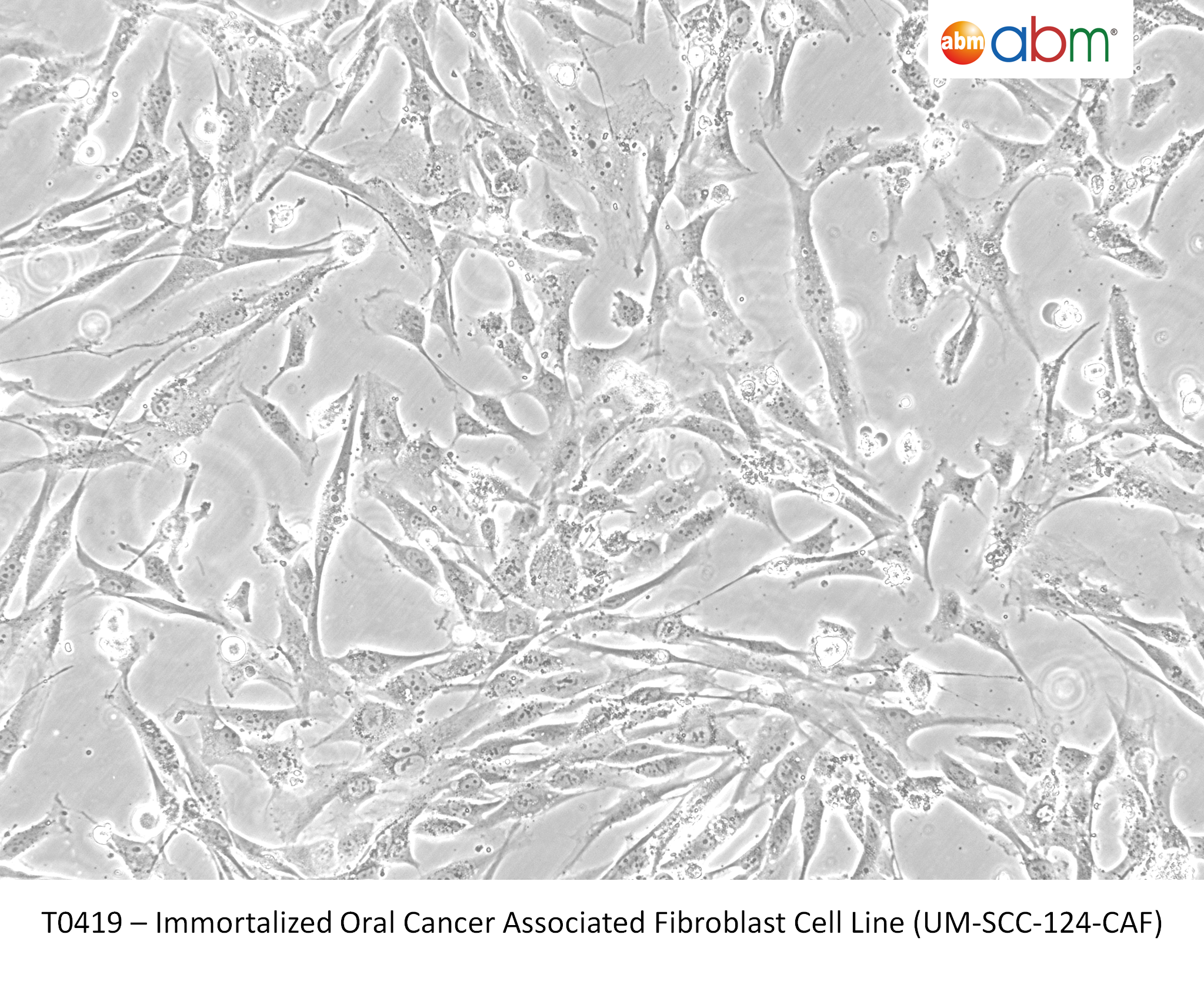 Immortalized Oral Cancer Associated Fibroblast Cell Line (UM-SCC-124 ...