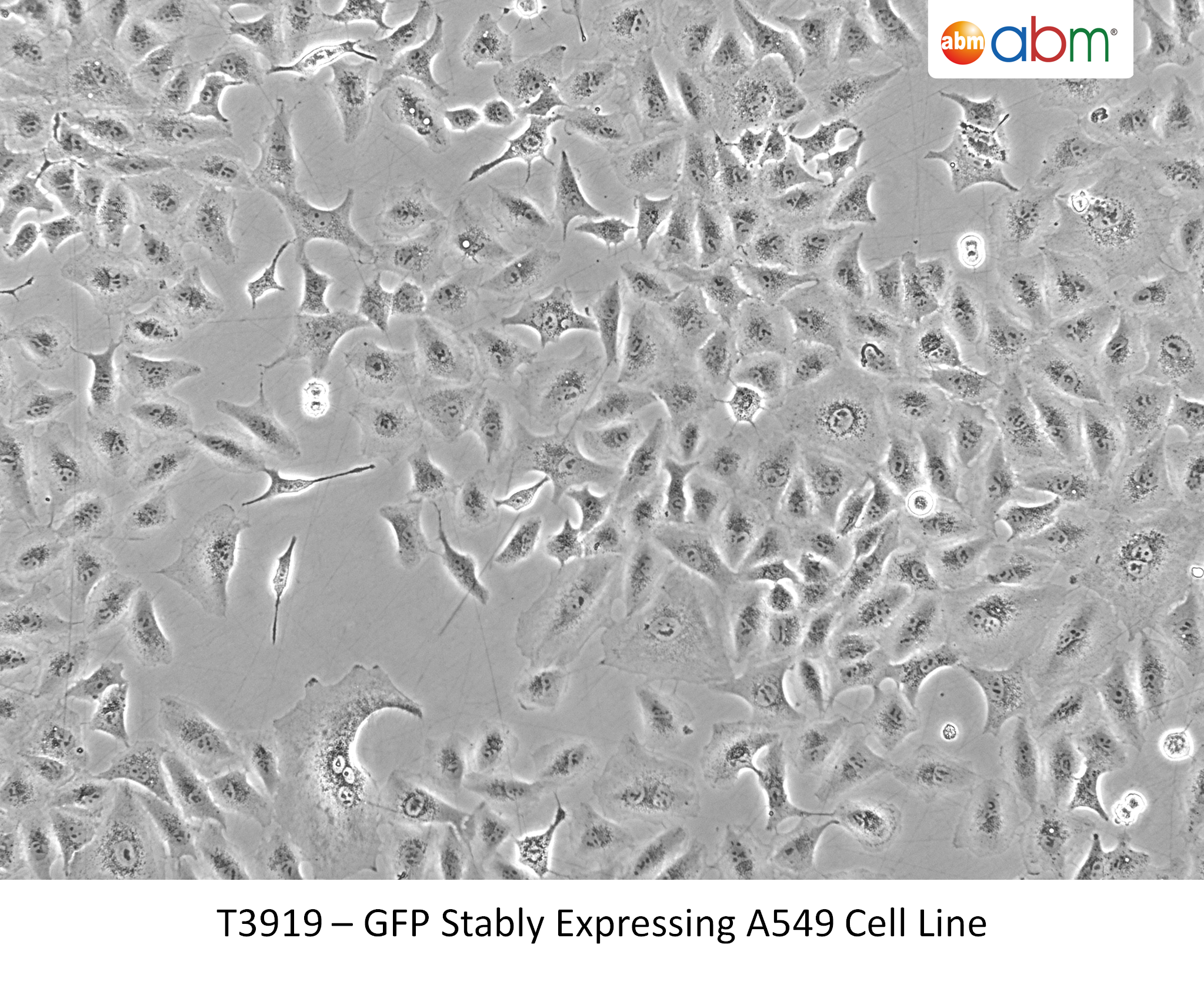GFP Stably Expressing A549 Cell Line | Applied Biological Materials Inc.