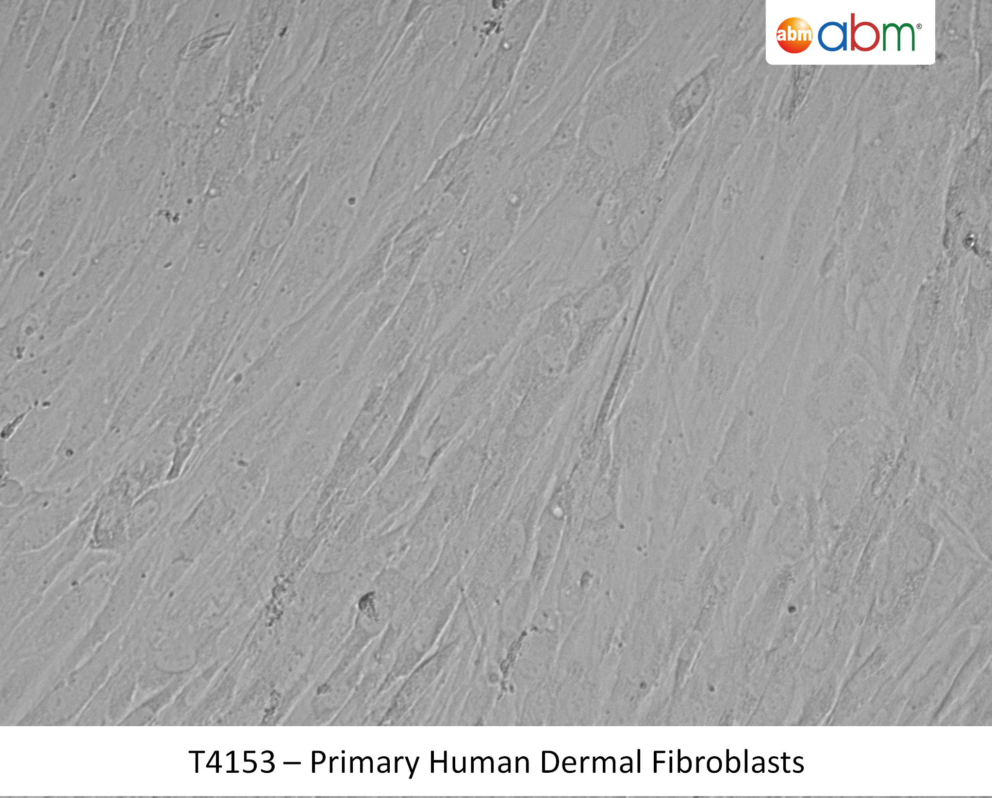 Primary Human Dermal Fibroblasts | Applied Biological Materials Inc.