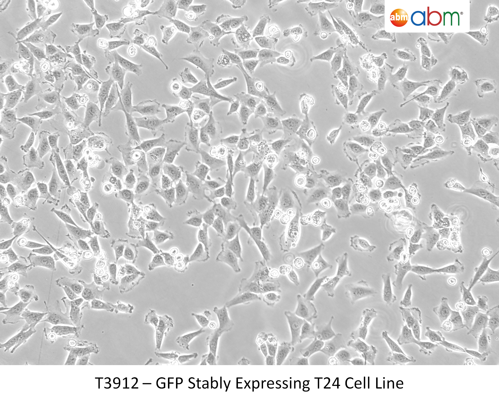 GFP Stably Expressing T24 Cell Line | Applied Biological Materials Inc.