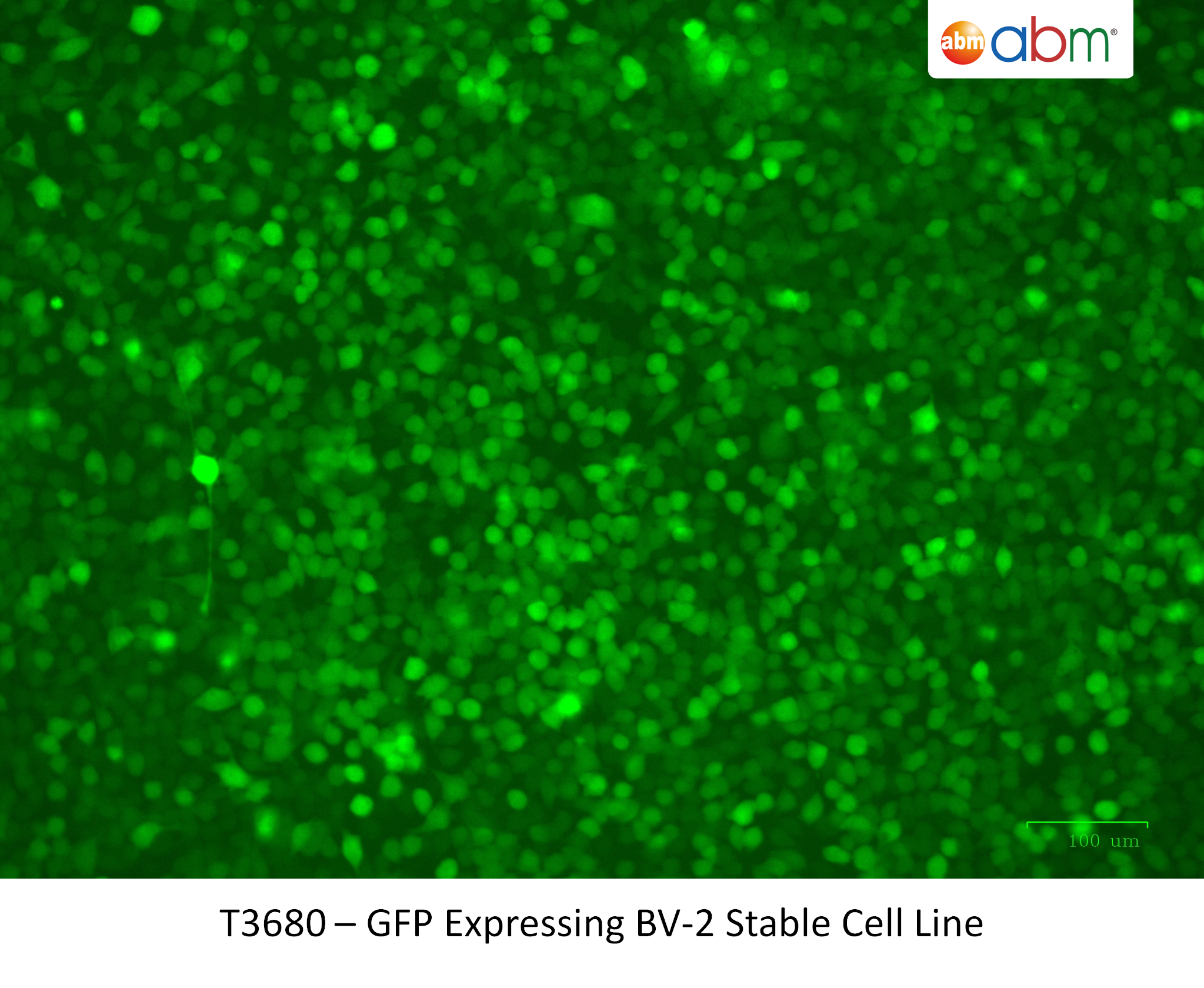 GFP Expressing BV-2 Stable Cell Line | Applied Biological Materials Inc.