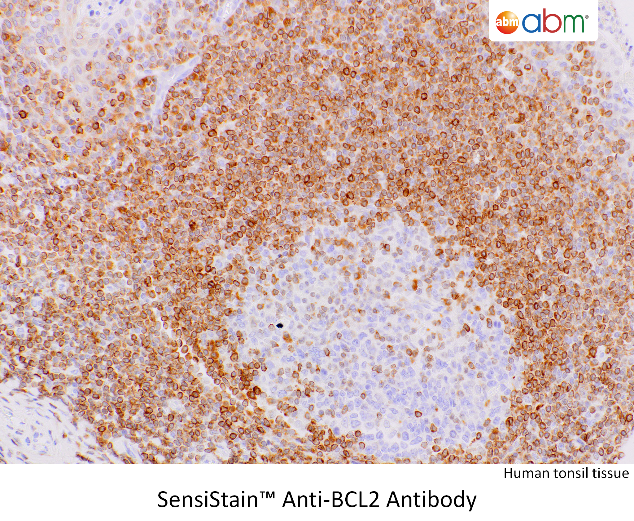 SensiStain™ Anti-BCL2 Antibody | Applied Biological Materials Inc.