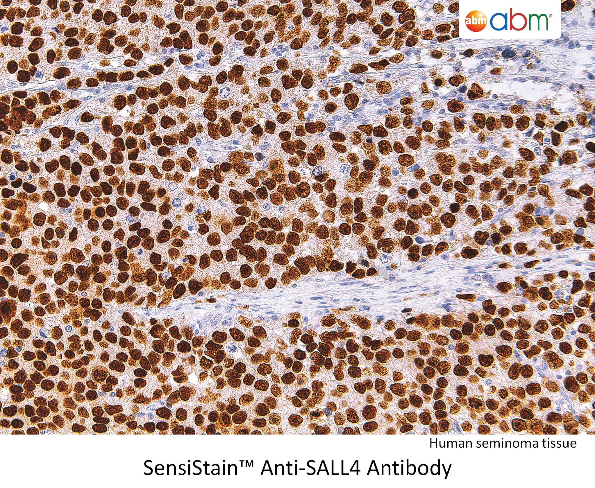 SensiStain™ Anti-SALL4 Antibody | Applied Biological Materials Inc.