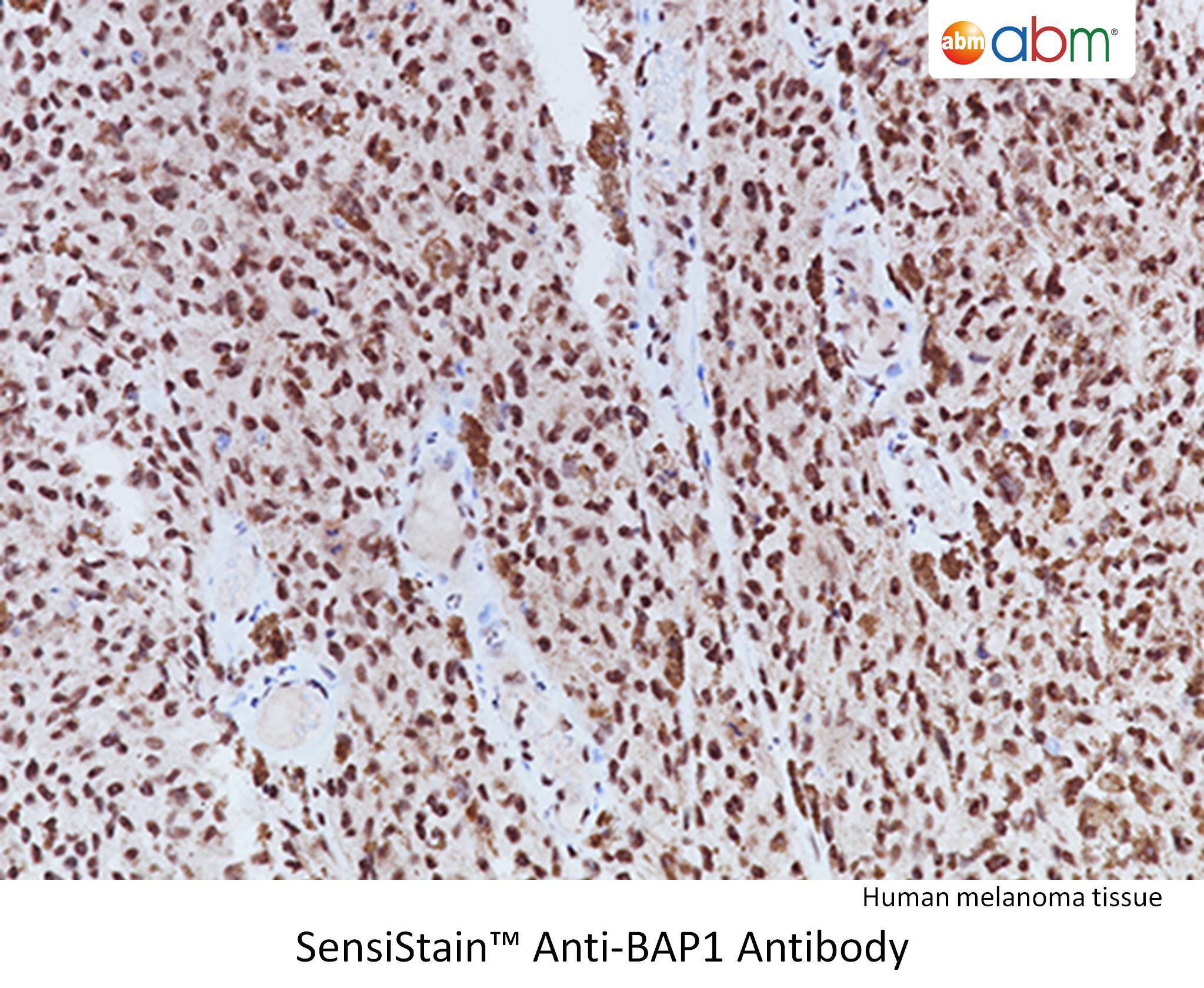 SensiStain™ Anti-BAP1 Antibody | Applied Biological Materials Inc.