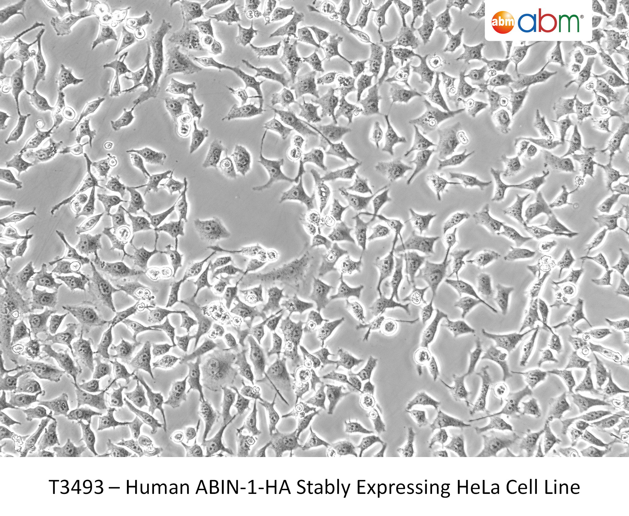 Human ABIN-1-HA Stably Expressing HeLa Cell Line | Applied Biological ...