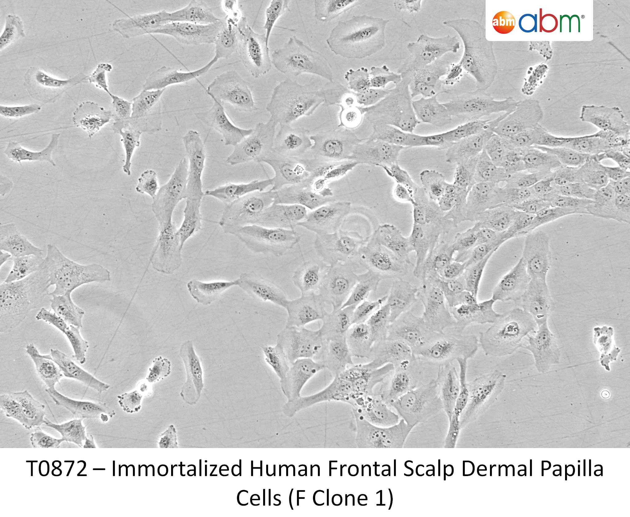 Immortalized Human Frontal Scalp Dermal Papilla Cells (F Clone 1 ...