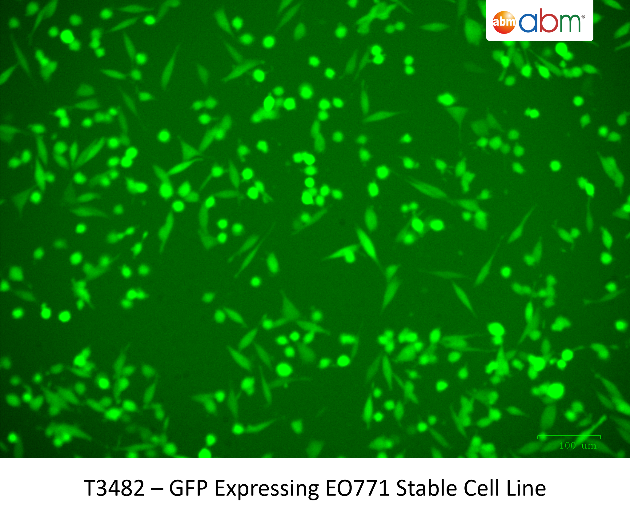 GFP Expressing EO771 Stable Cell Line | Applied Biological Materials Inc.