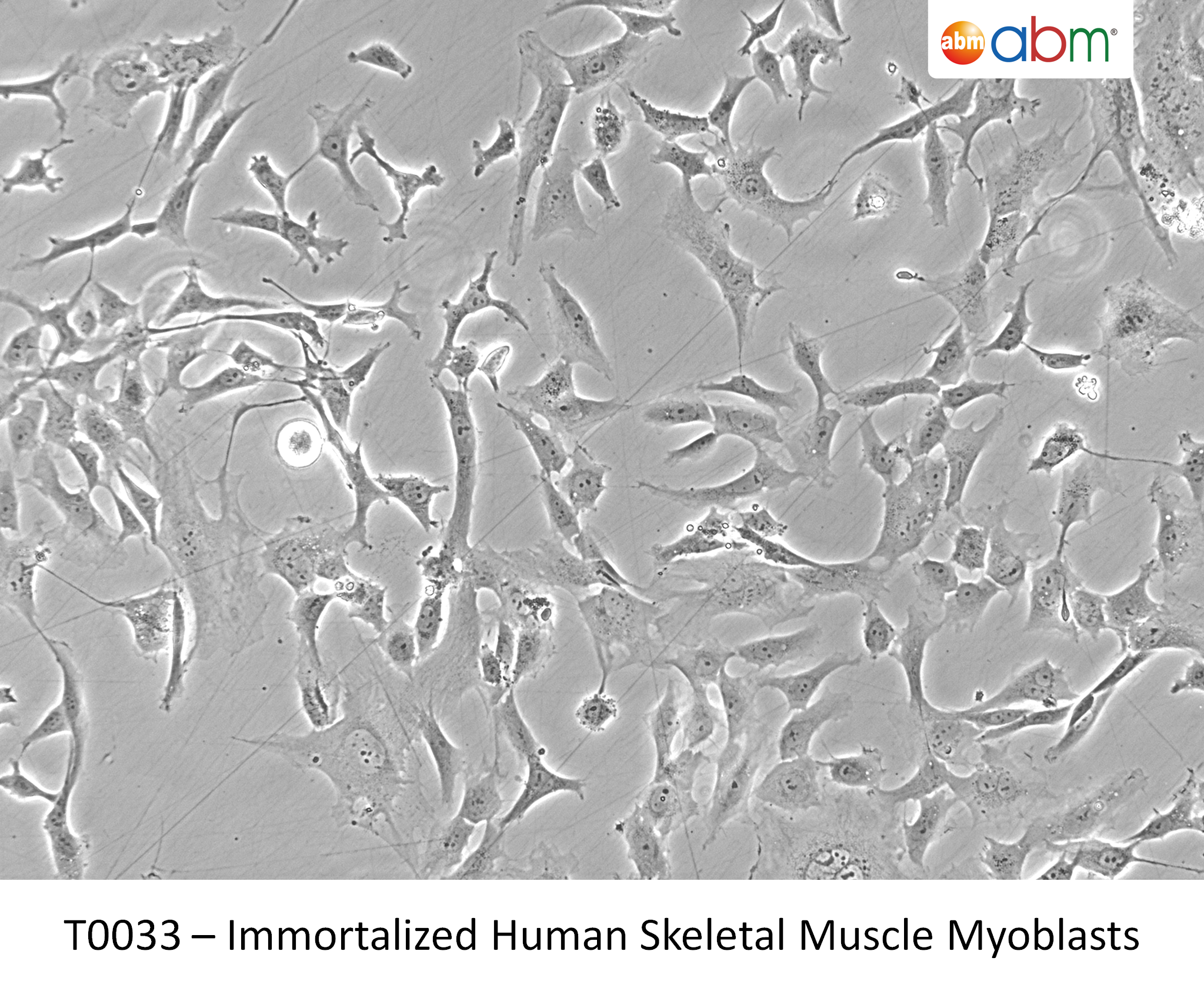 Immortalized Human Skeletal Muscle Myoblasts - Homo sapiens/Human ...