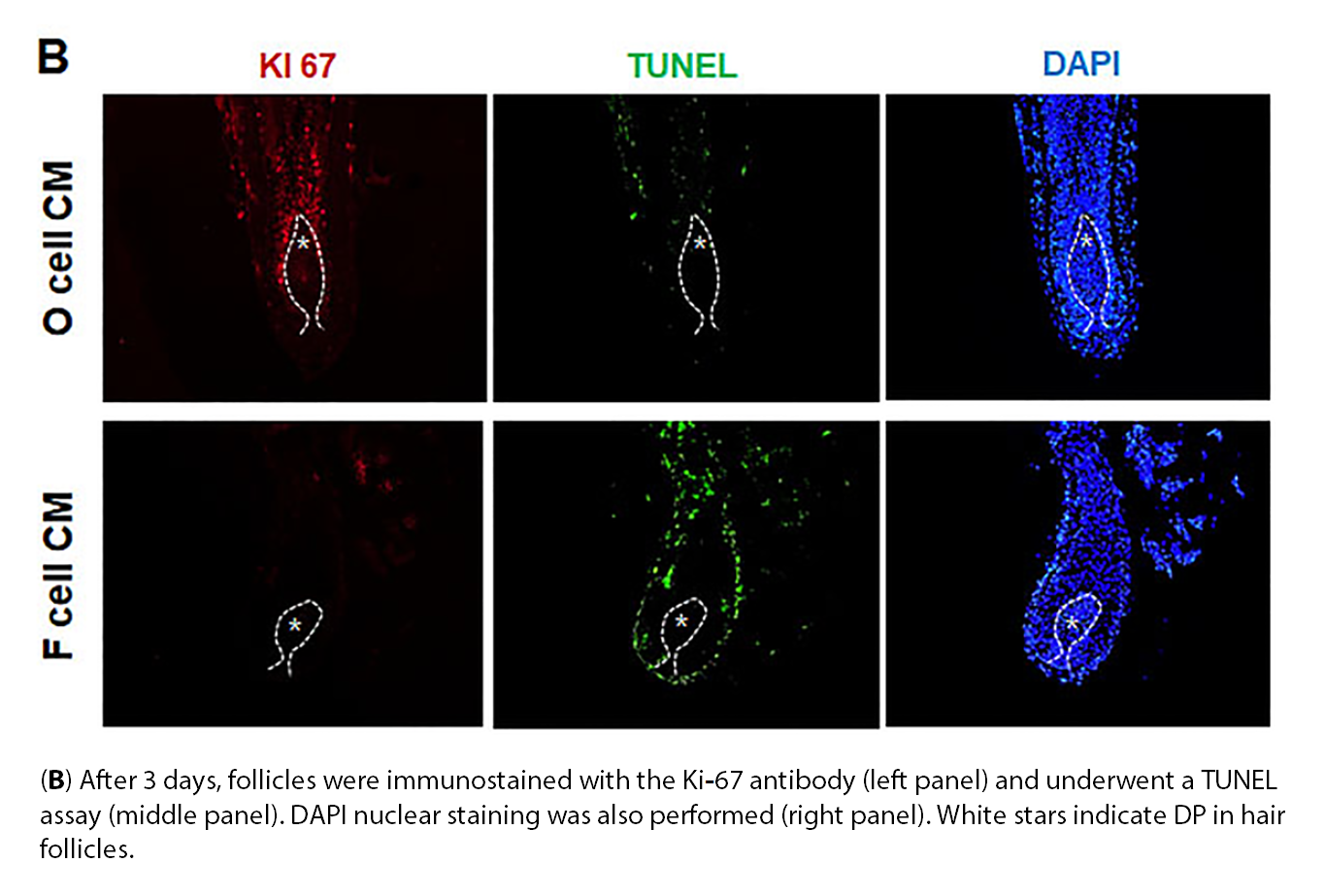 Immortalized Human Frontal Scalp Dermal Papilla Cells (F Clone 2 ...