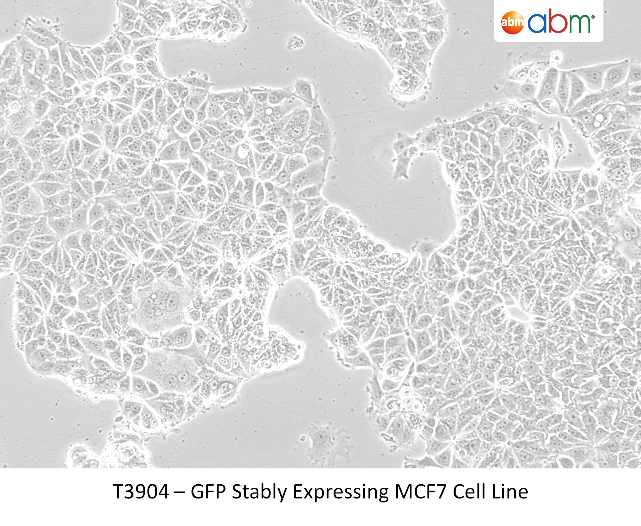 GFP Stably Expressing MCF7 Cell Line | Applied Biological Materials Inc.