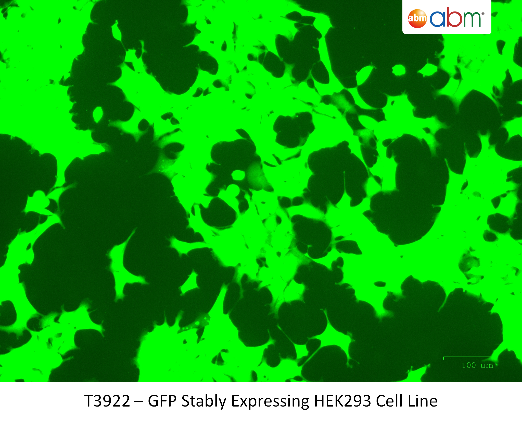 GFP Stably Expressing HEK293 Cell Line | Applied Biological Materials Inc.