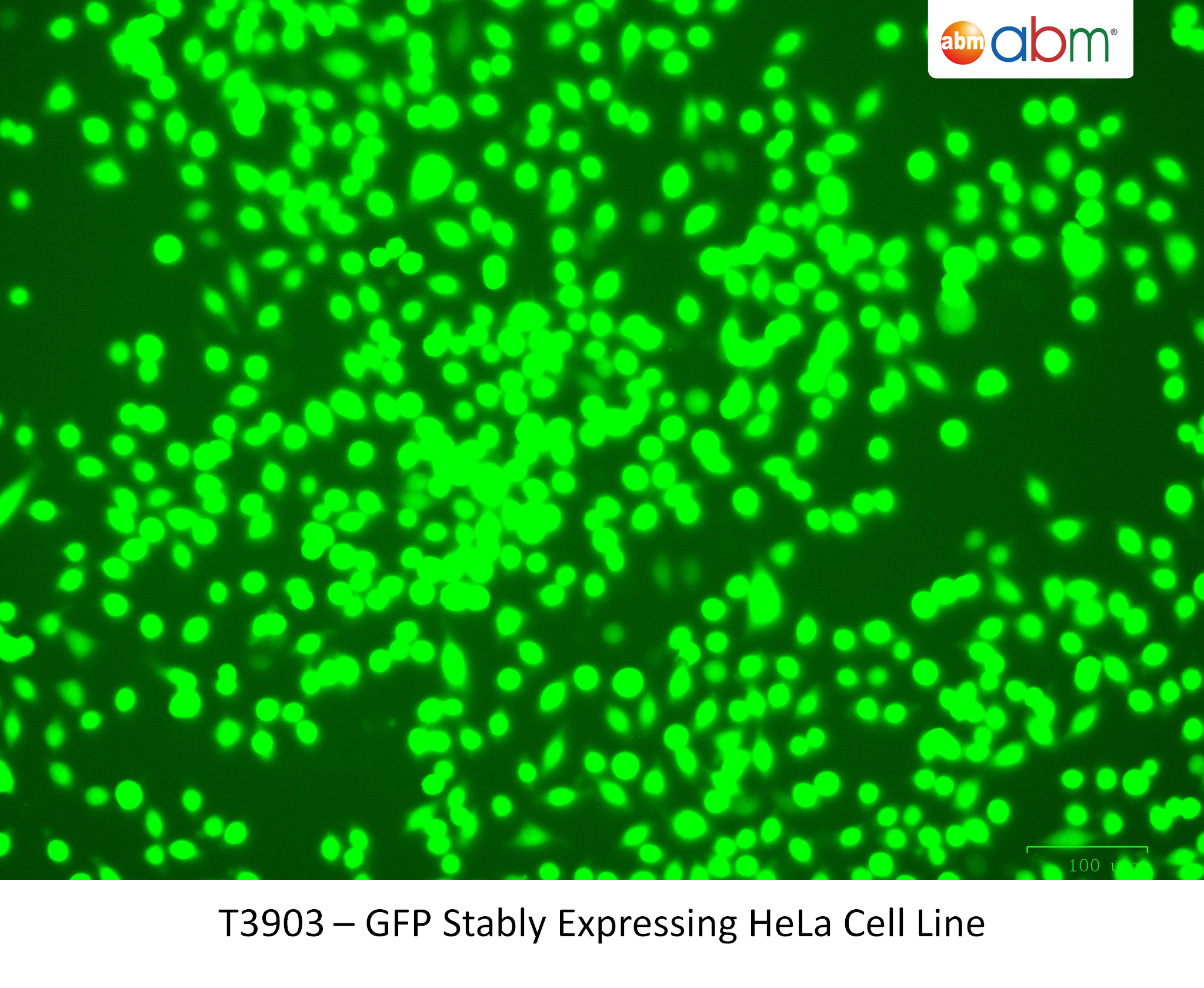 GFP Stably Expressing HeLa Cell Line | Applied Biological Materials Inc.