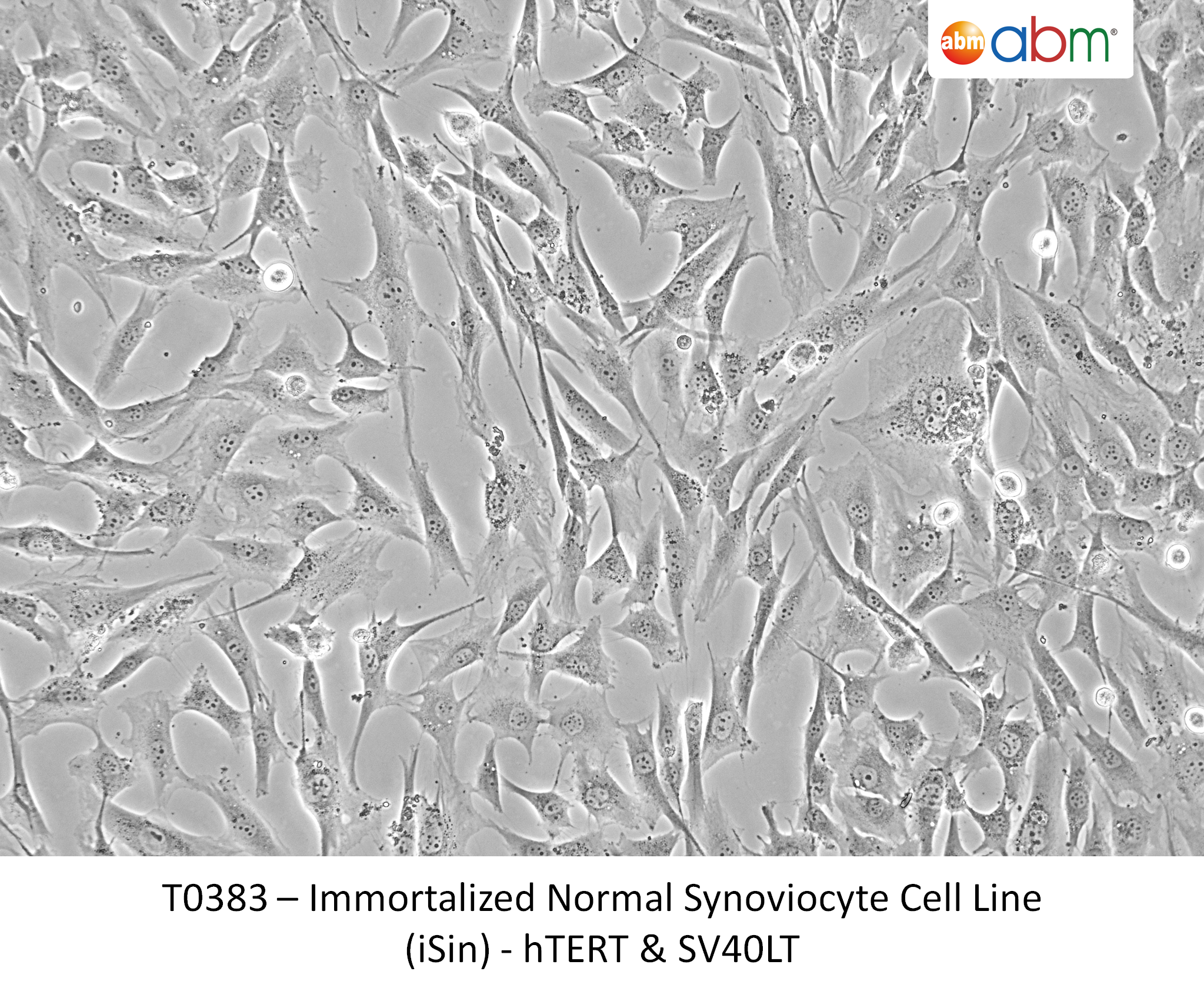 Immortalized Normal Synoviocyte Cell Line (iSin) - hTERT & SV40LT ...