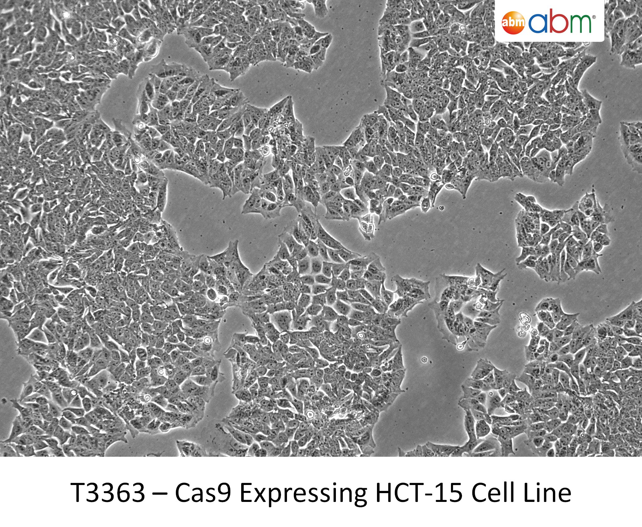 Cas9 Expressing HCT-15 Cell Line | Applied Biological Materials Inc.