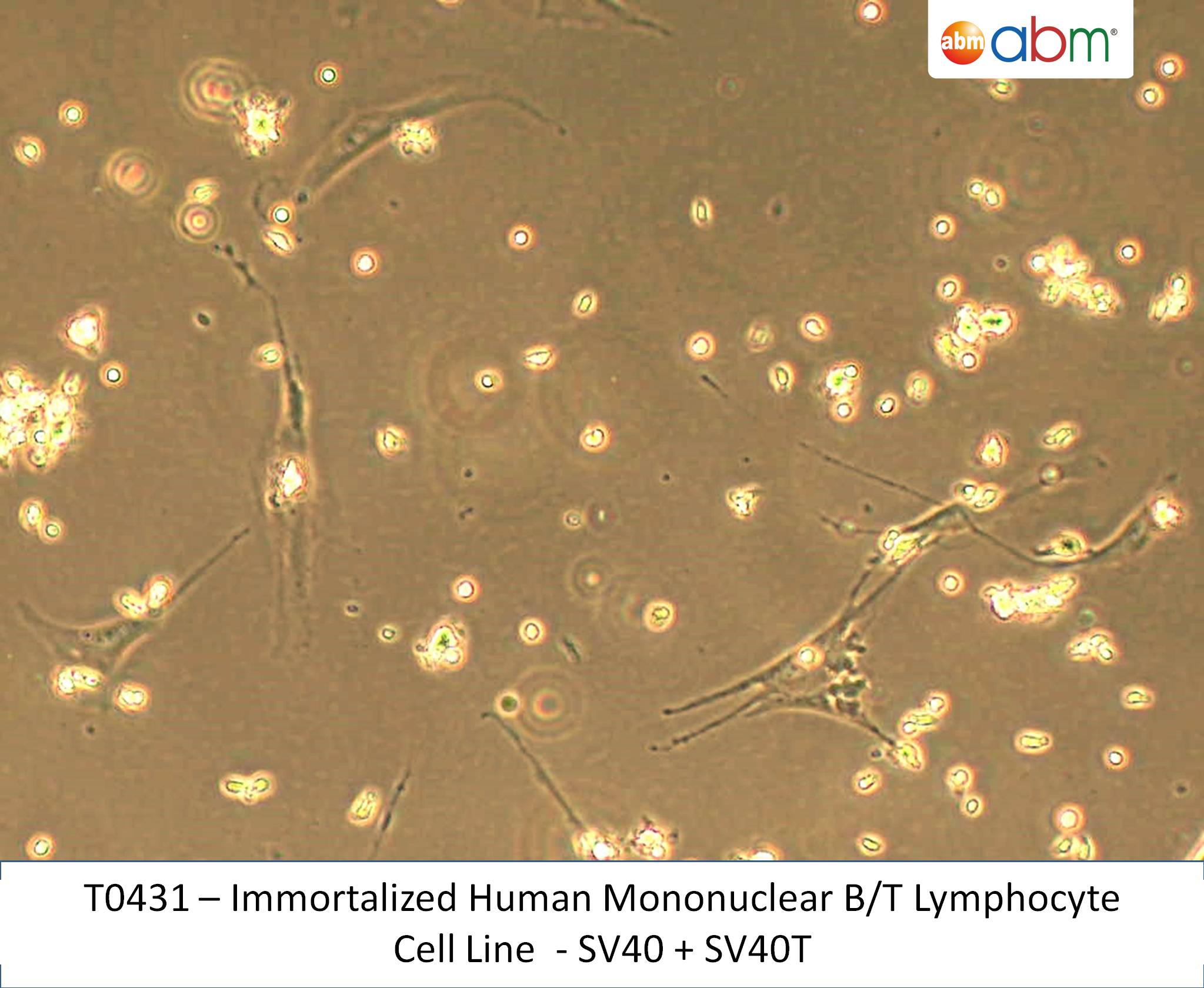 Immortalized Human Mononuclear B/T Lymphocyte Cell Line - SV40 + SV40T ...