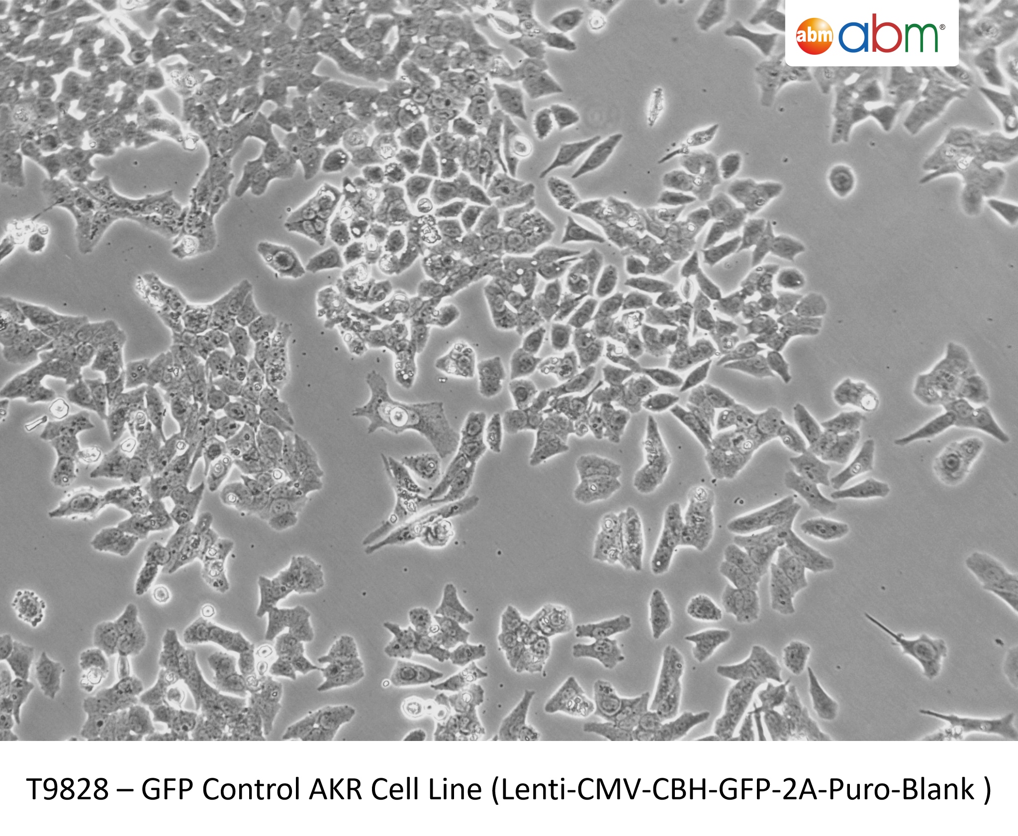 GFP Expressing AKR Stable Cell Line | Applied Biological Materials Inc.