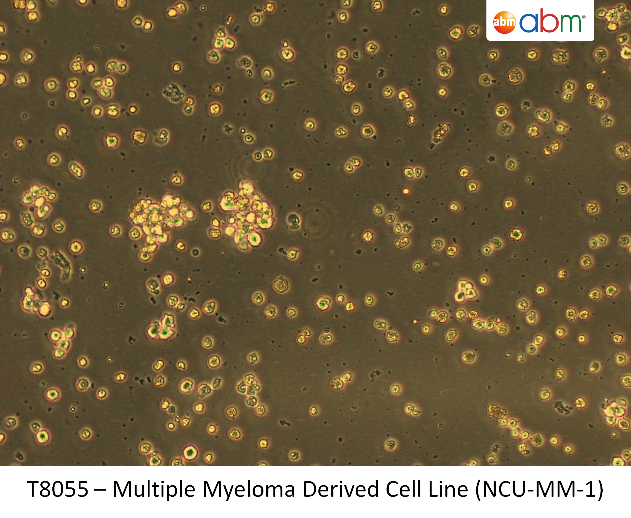 Multiple Myeloma Derived Cell Line (NCU-MM-1) | Applied Biological ...