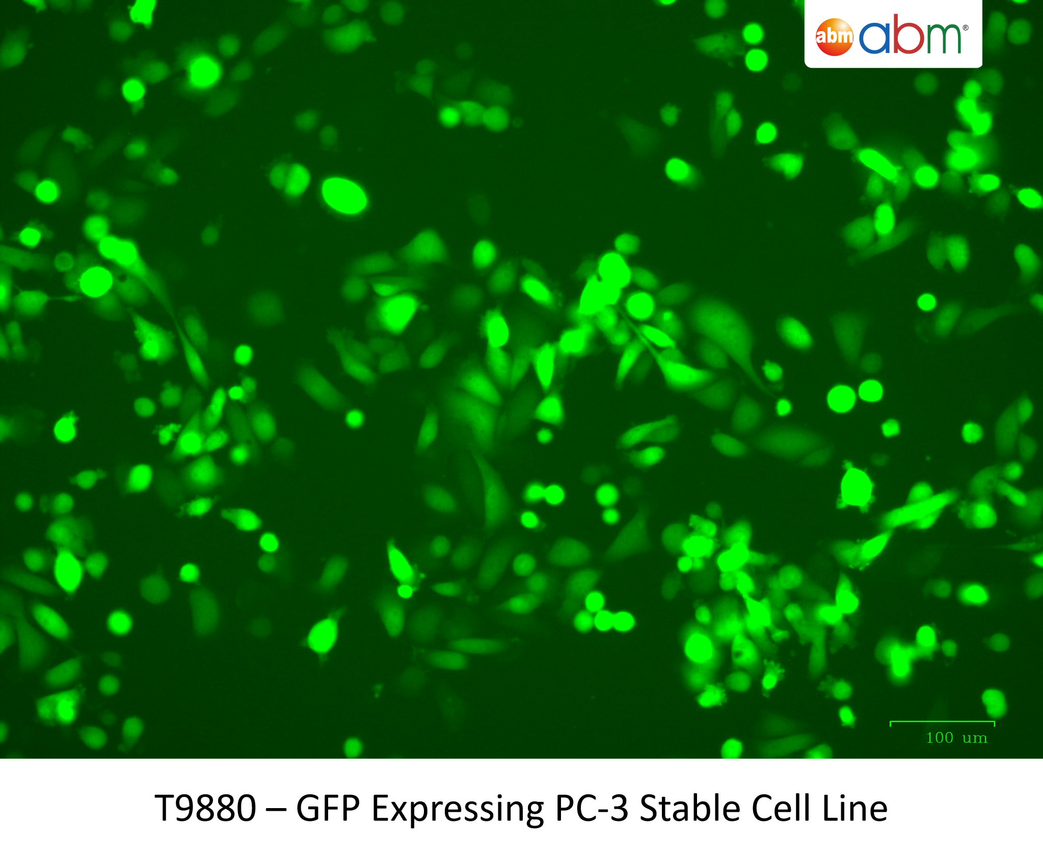 GFP Expressing PC-3 Stable Cell Line | Applied Biological Materials Inc.