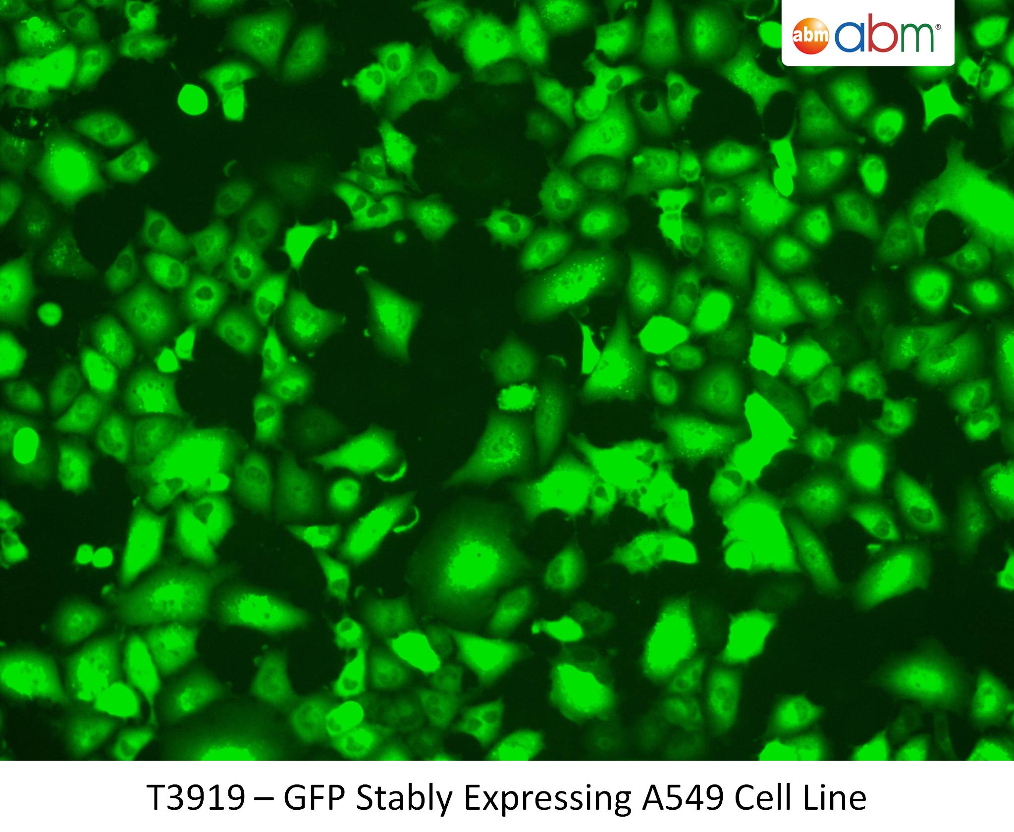 GFP Stably Expressing A549 Cell Line | Applied Biological Materials Inc.