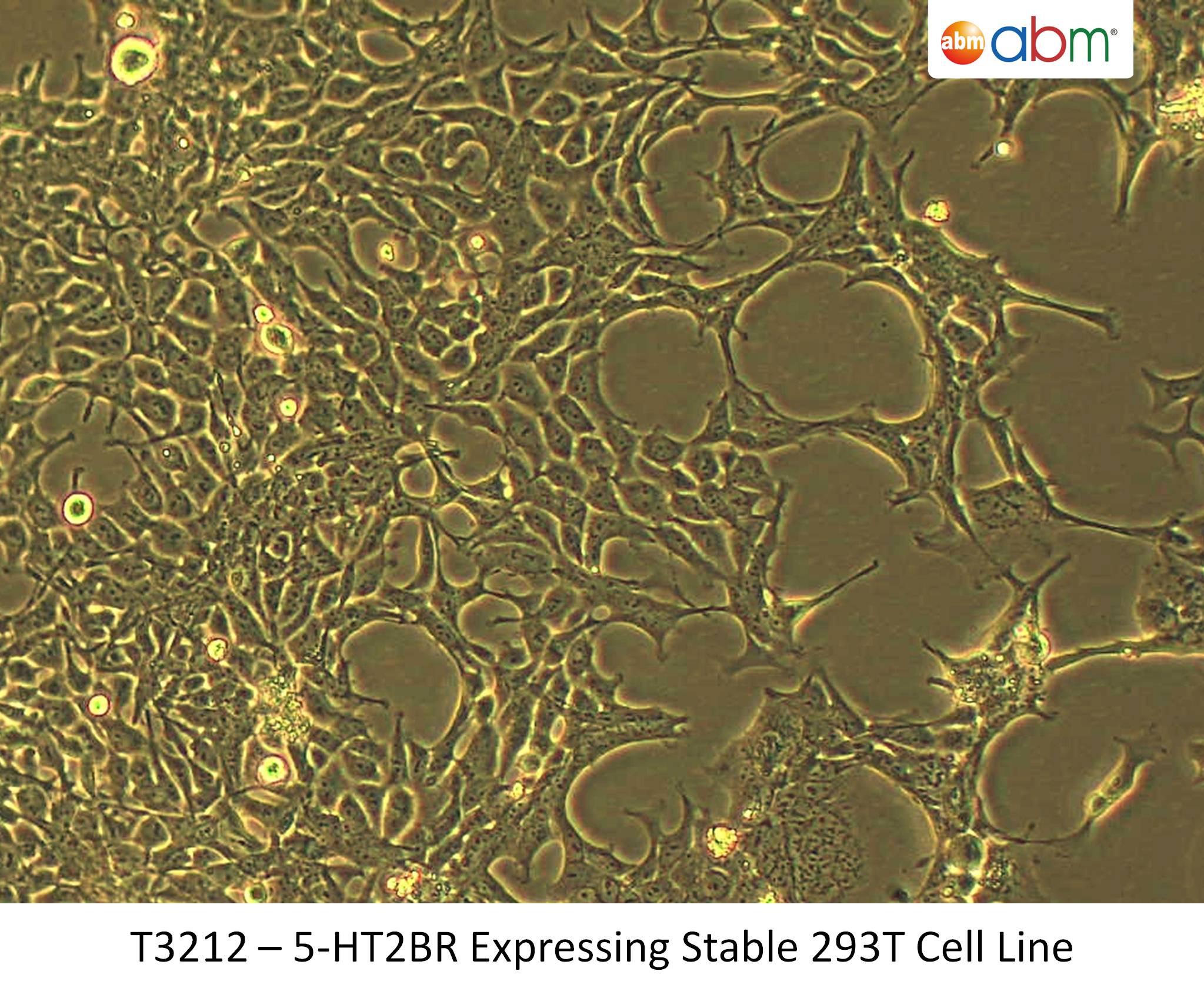 5-HT2BR Expressing Stable 293T Cell Line | Applied Biological Materials ...