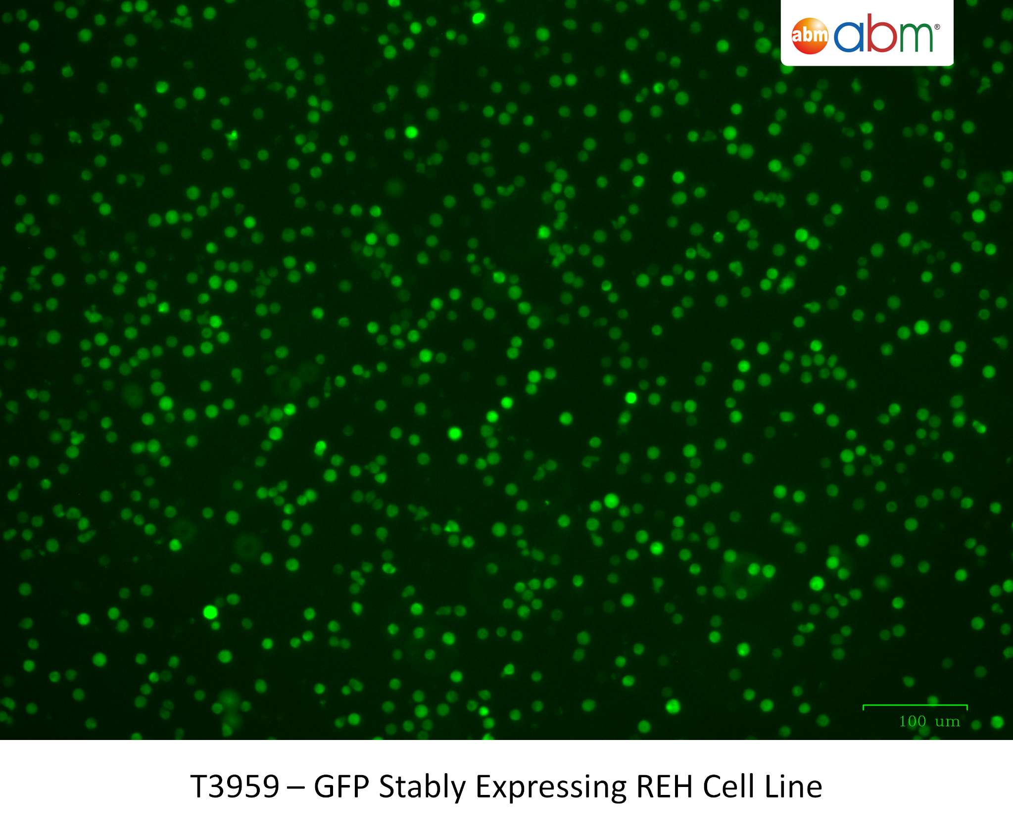 GFP Stably Expressing REH Cell Line | Applied Biological Materials Inc.