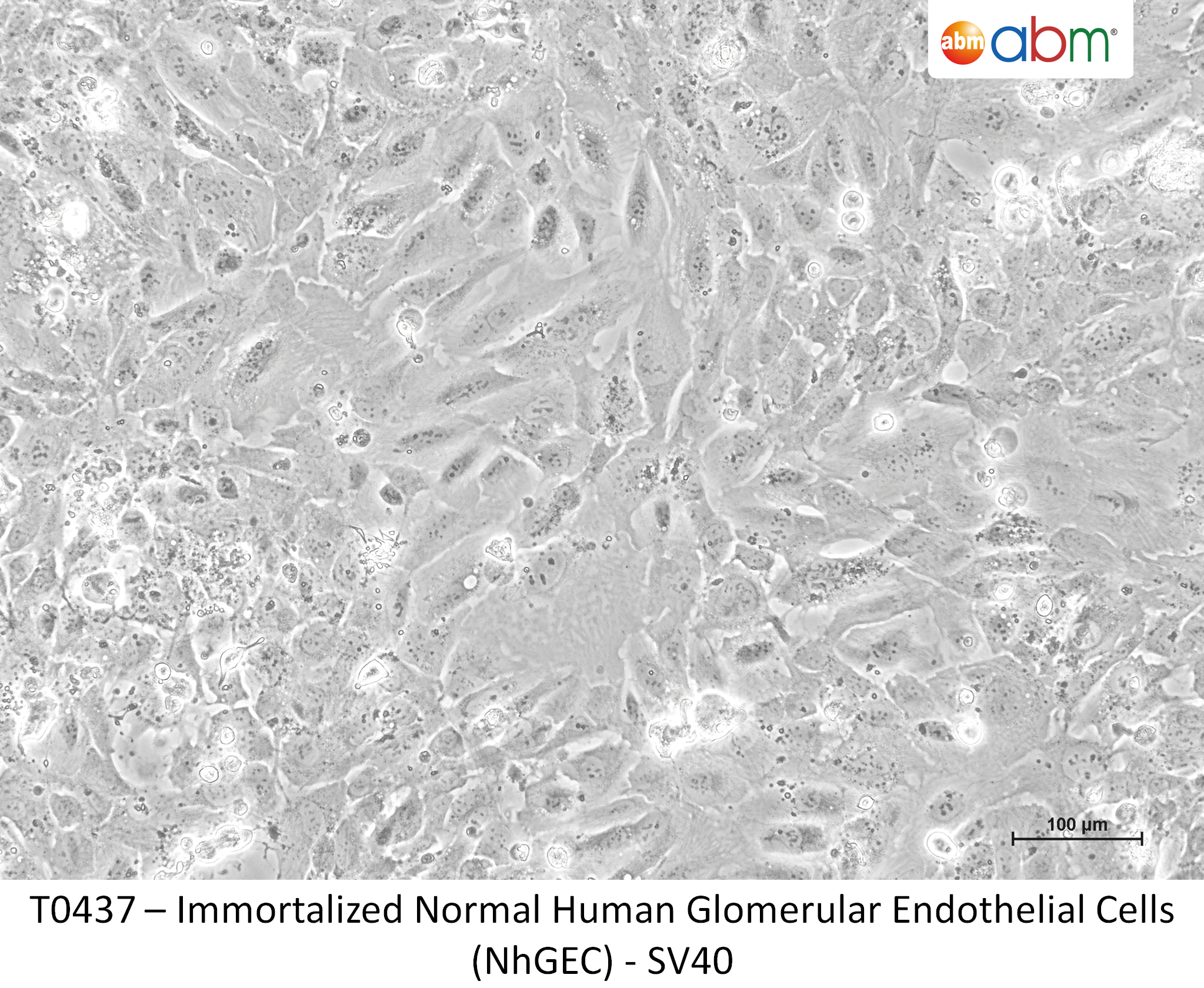 Immortalized Normal Human Glomerular Endothelial Cells (NhGEC) - SV40 ...