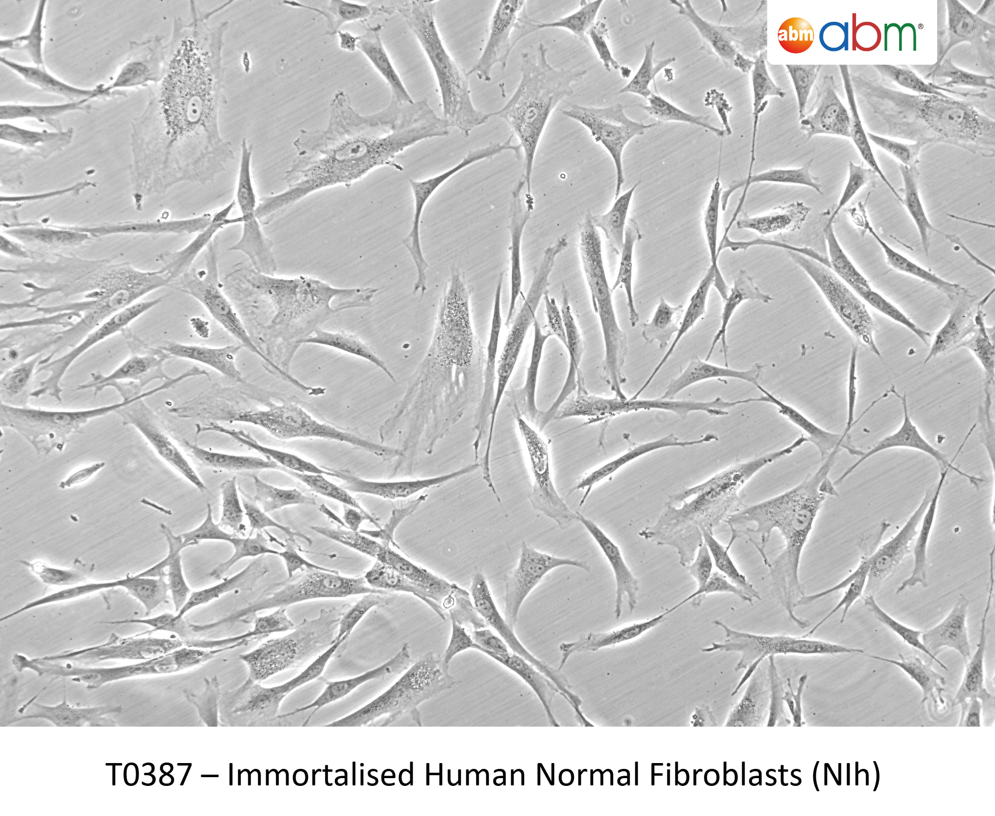Immortalised Human Normal Fibroblasts (NIh) | Applied Biological ...