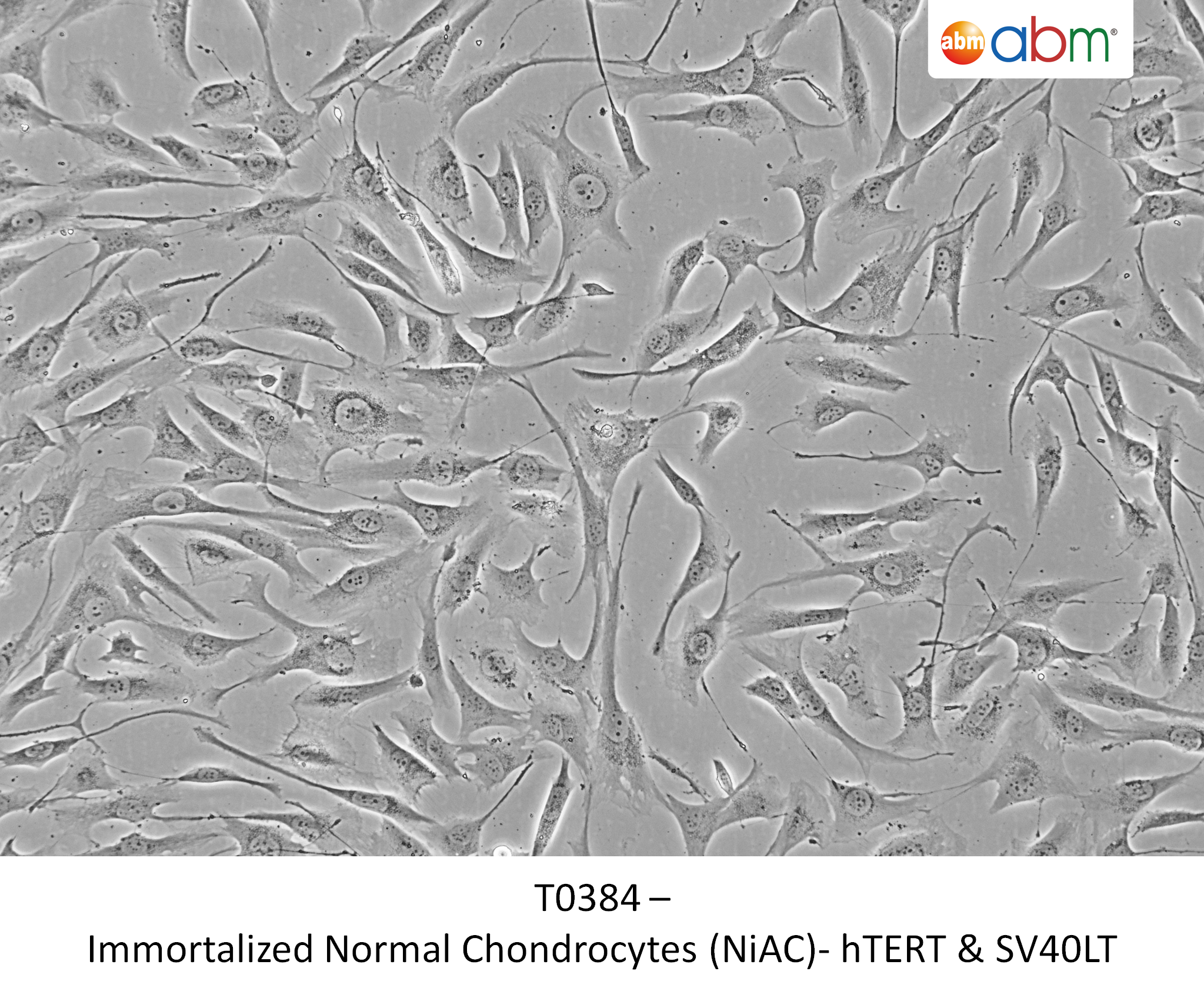 Immortalized Normal Chondrocytes (NiAC)- hTERT & SV40LT | Applied ...