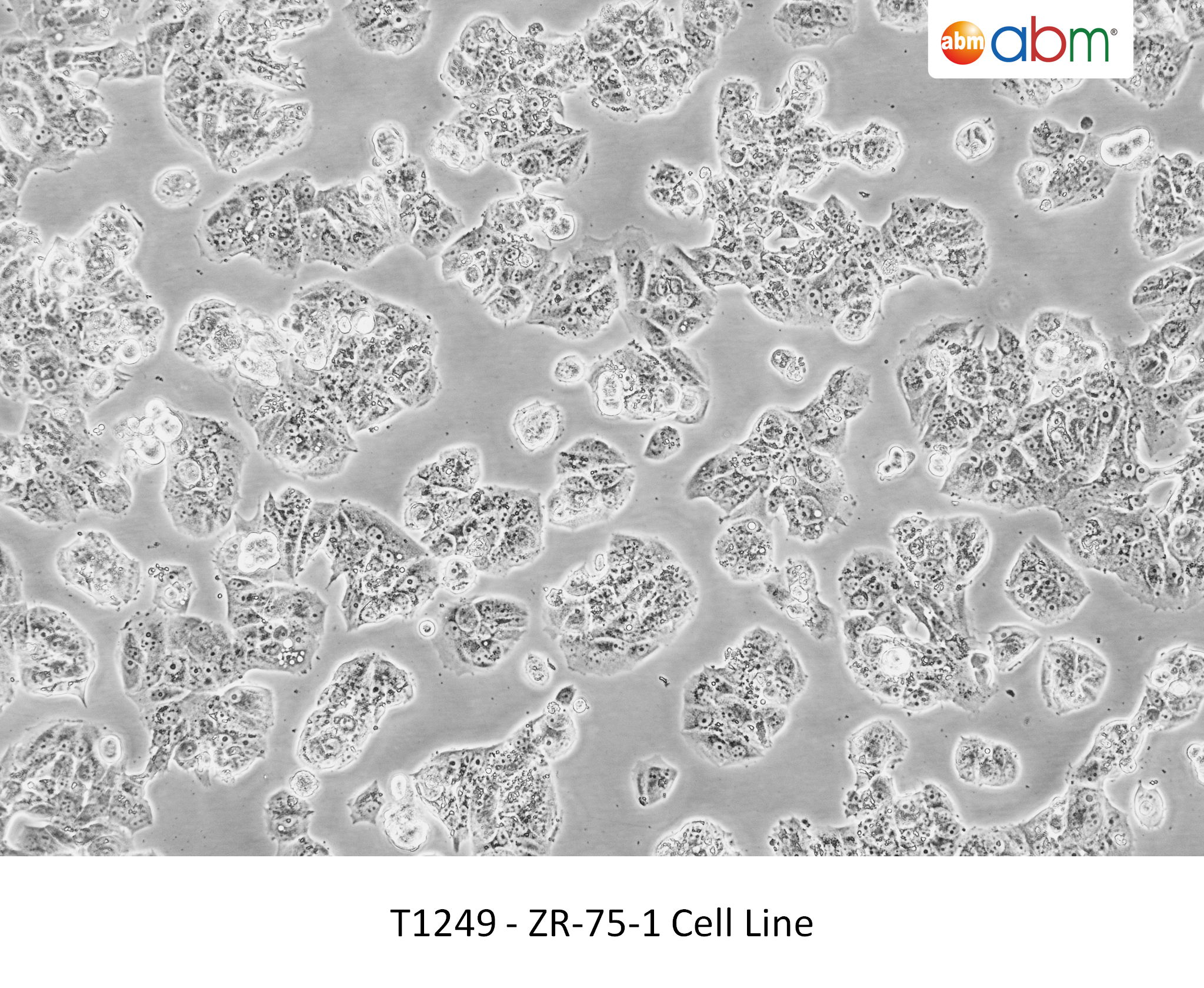 ZR-75-1 Cell Line | Applied Biological Materials Inc.