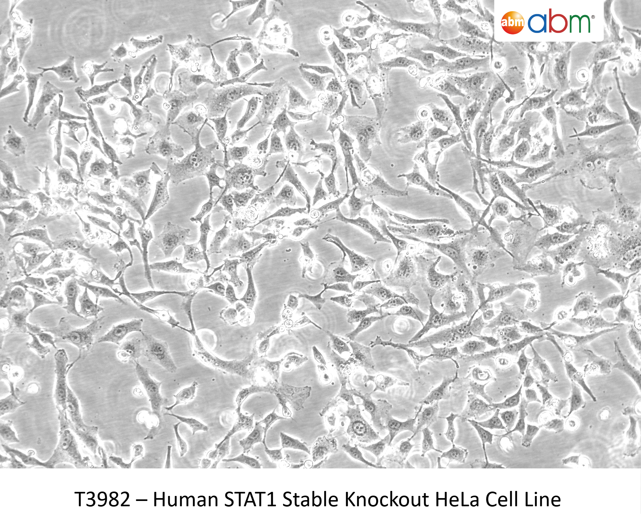 Human STAT1 Stable Knockout HeLa Cell Line | Applied Biological ...