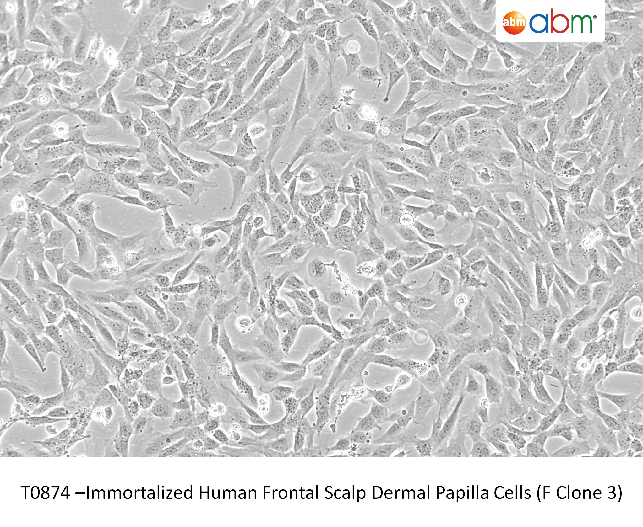 Immortalized Human Frontal Scalp Dermal Papilla Cells (F Clone 3 ...